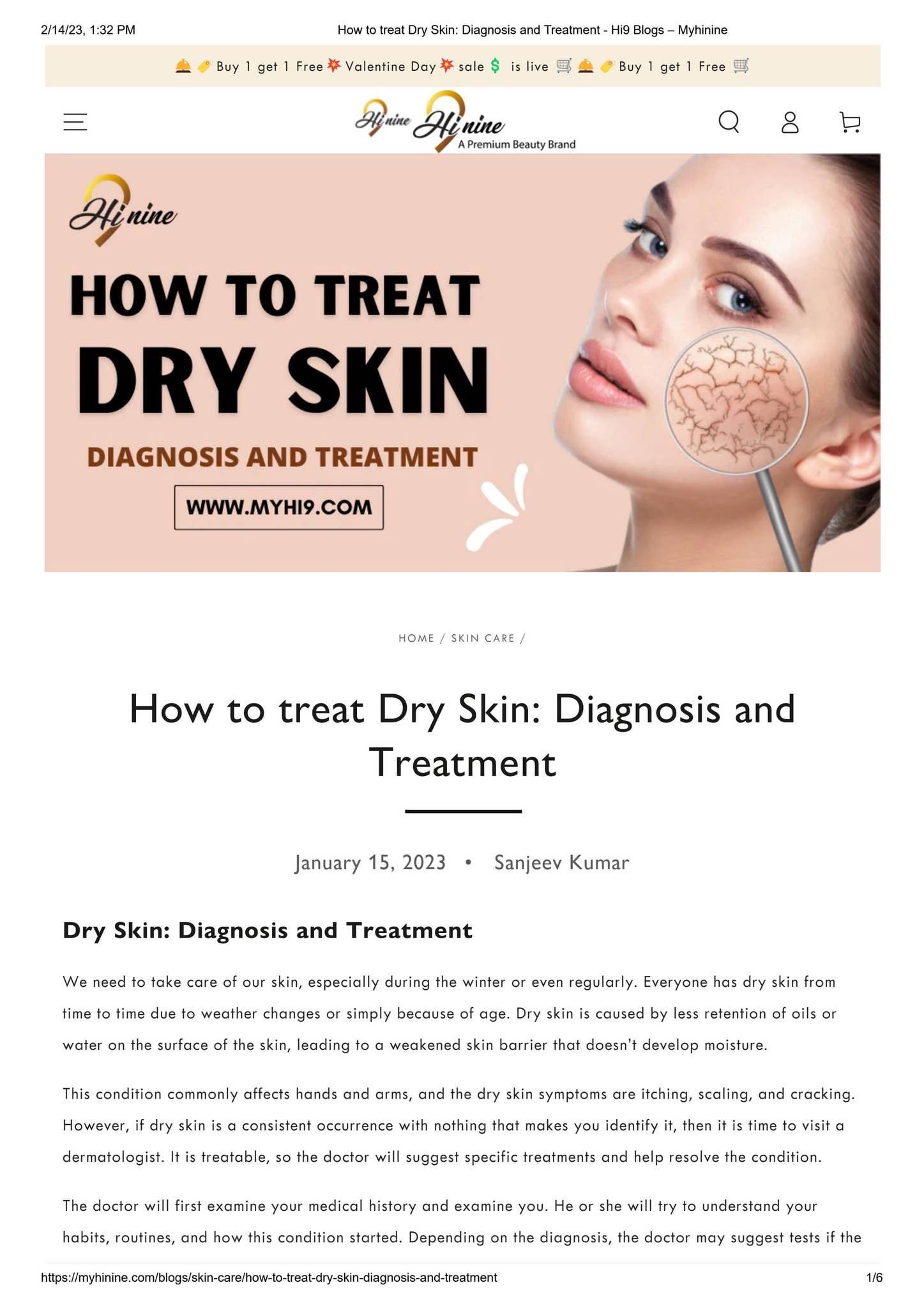 How to treat Dry Skin Diagnosis and Treatment by Sanjeev kumar - Issuu