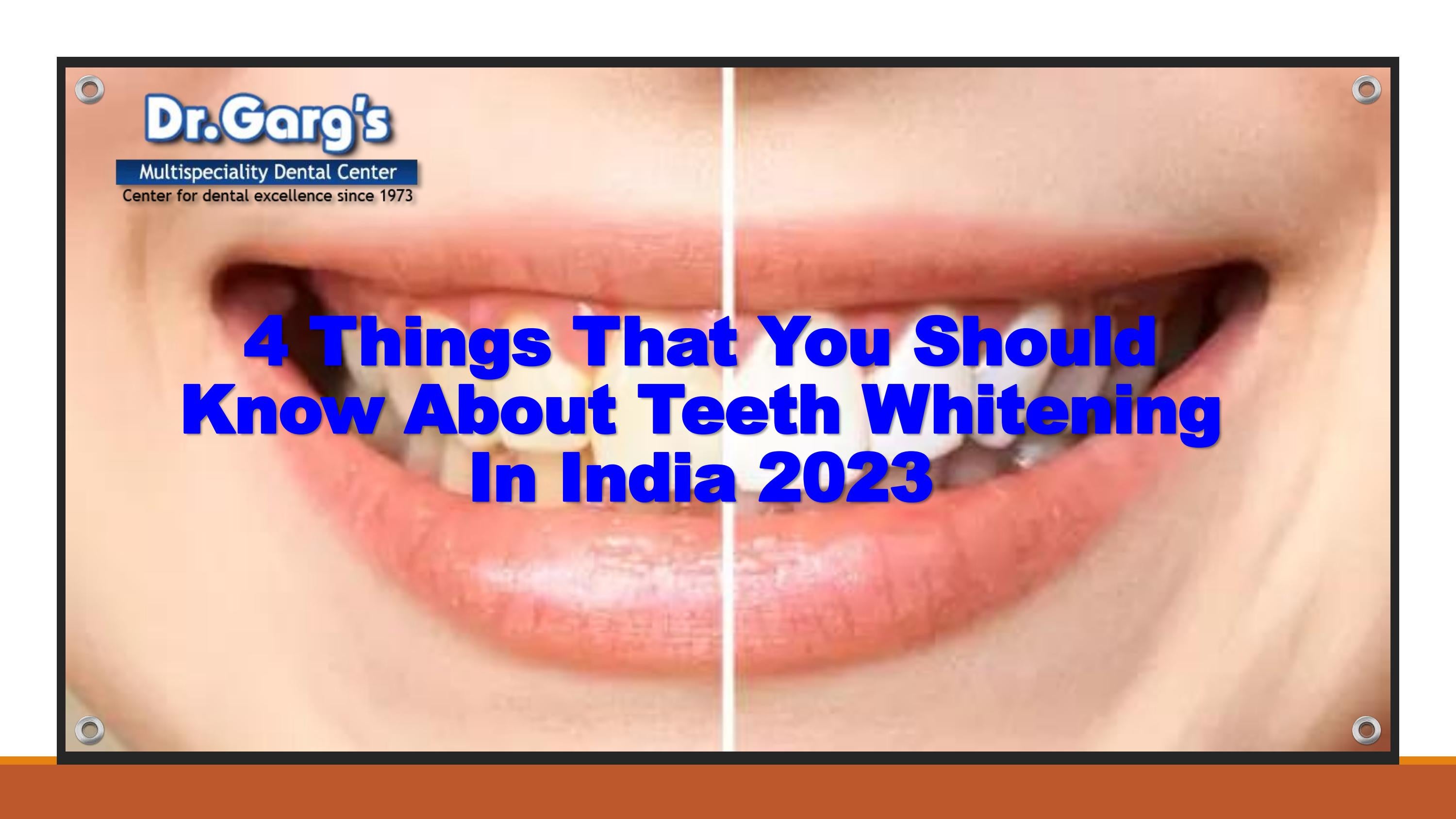4 Things That You Should Know About Teeth Whitening In India 2023 by ...
