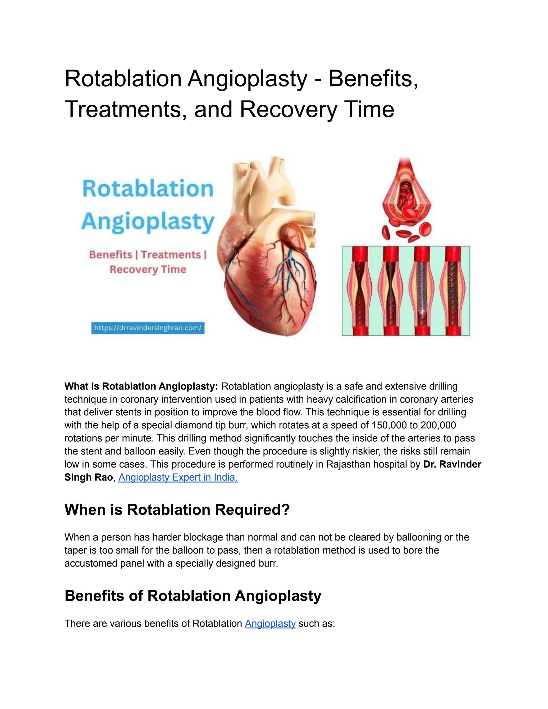 Rotablation Angioplasty – Benefits, Treatments, and Recovery Time by Dr ...
