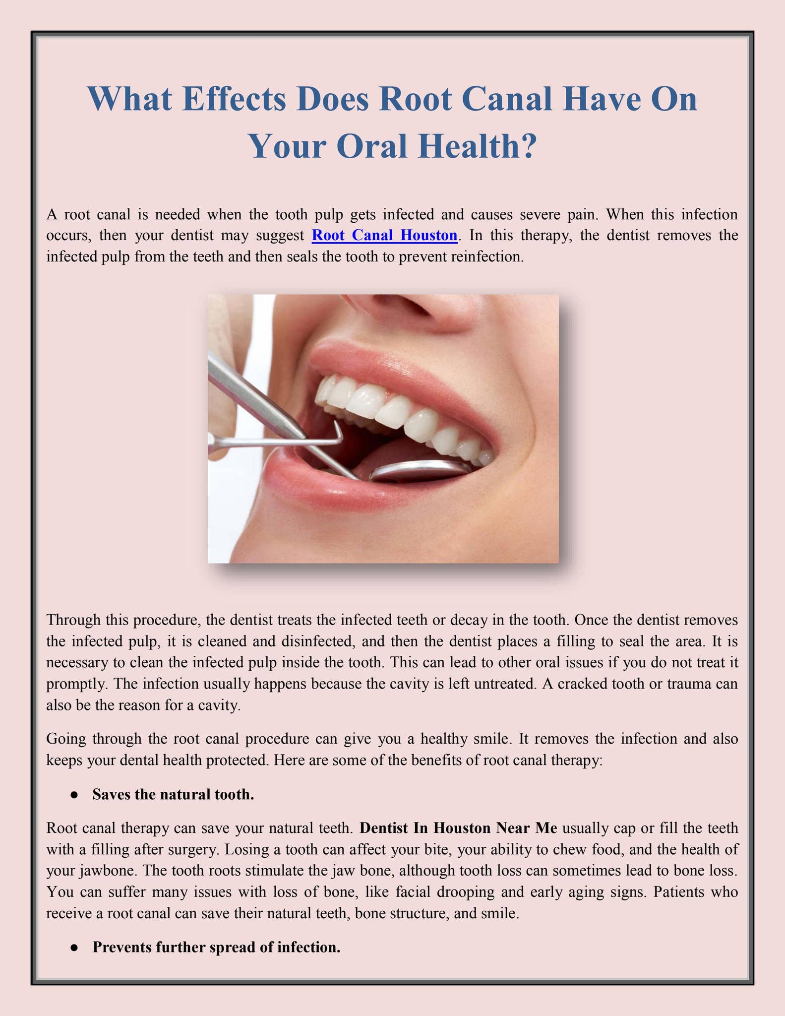 What Effects Does Root Canal Have On Your Oral Health? by Edge Dental ...