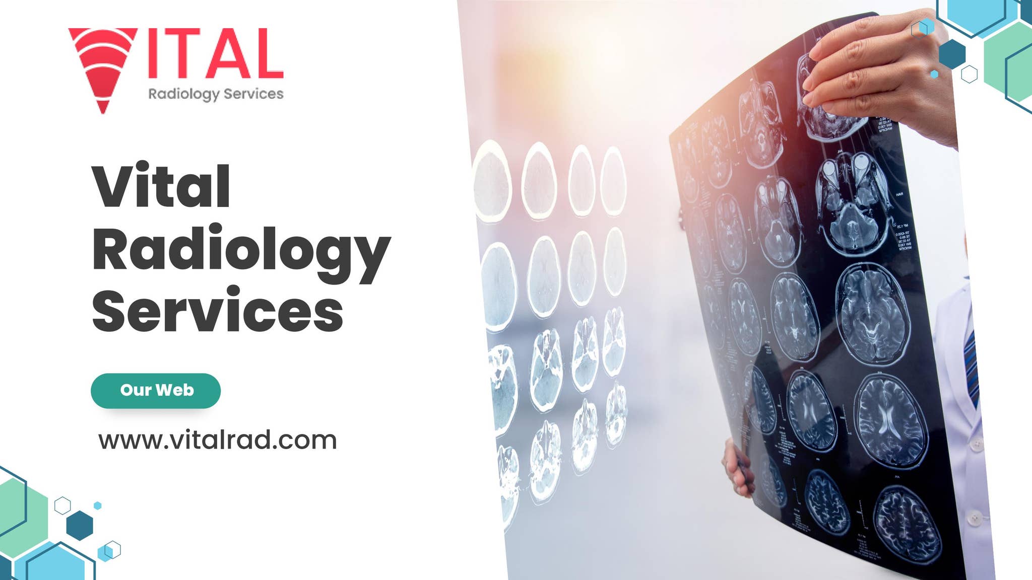 MRI Second Opinion by vitalrad India - Issuu