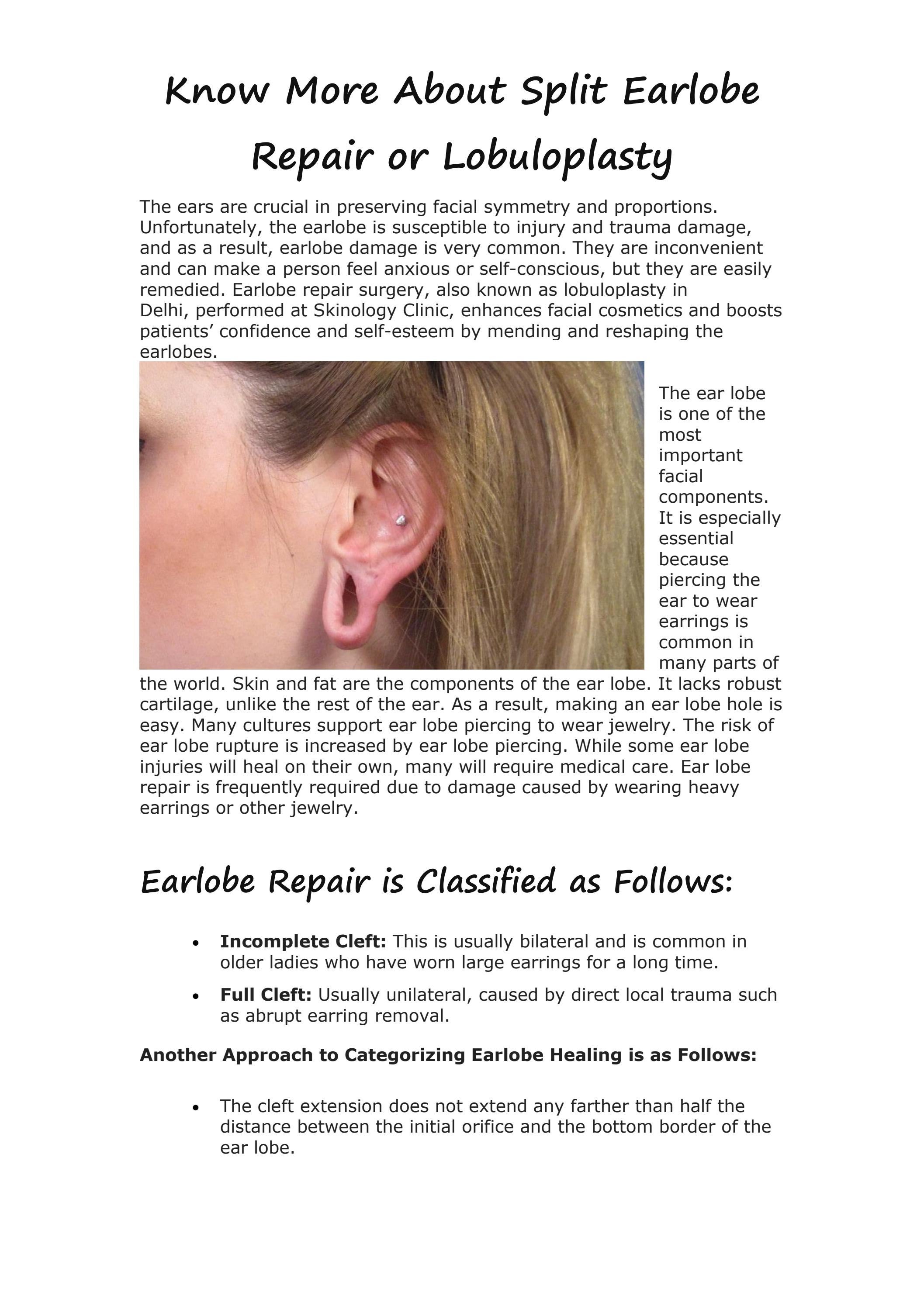 Know More About Split Earlobe Repair or Lobuloplasty by Varsha Sharma ...