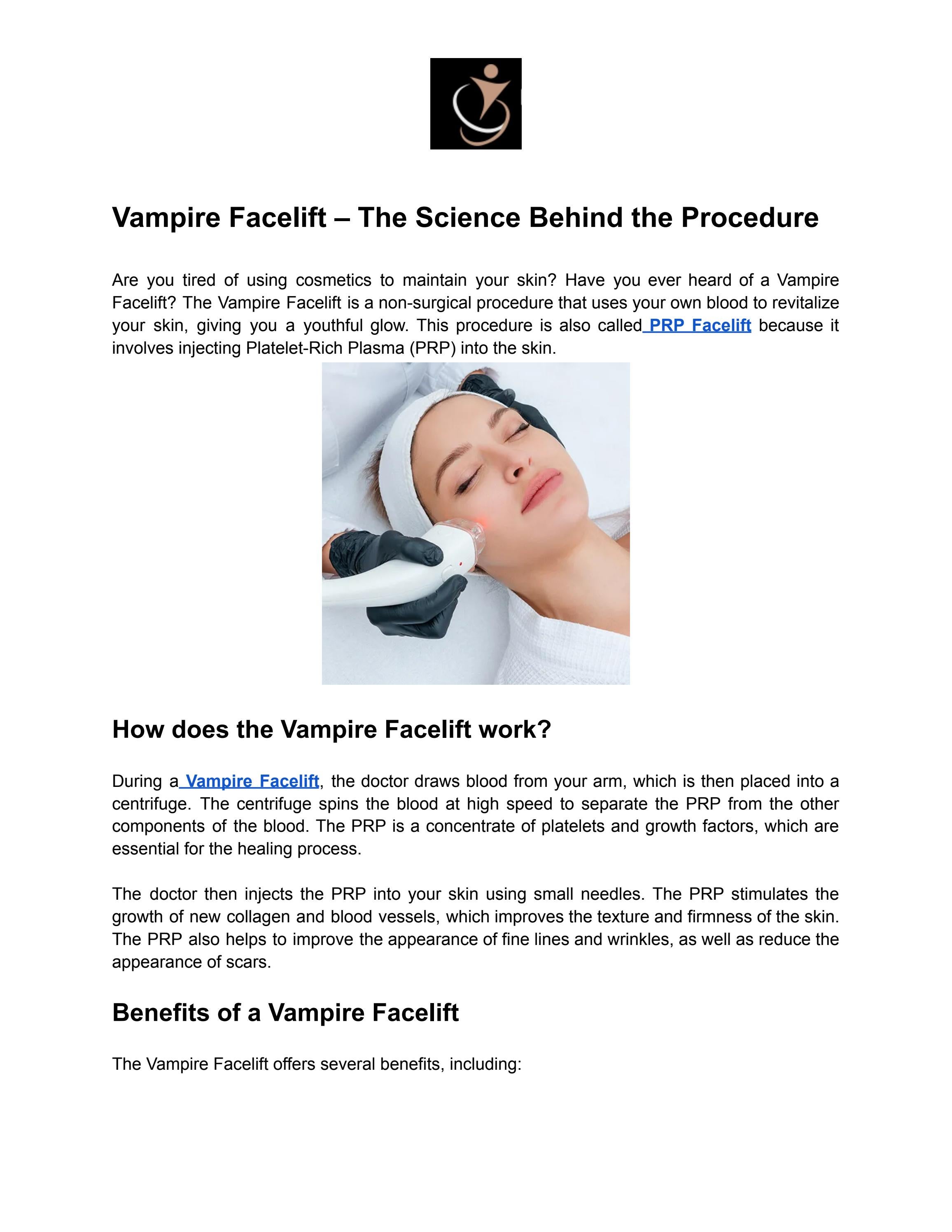 Vampire Facelift – The Science Behind the Procedure by Lifestyle ...