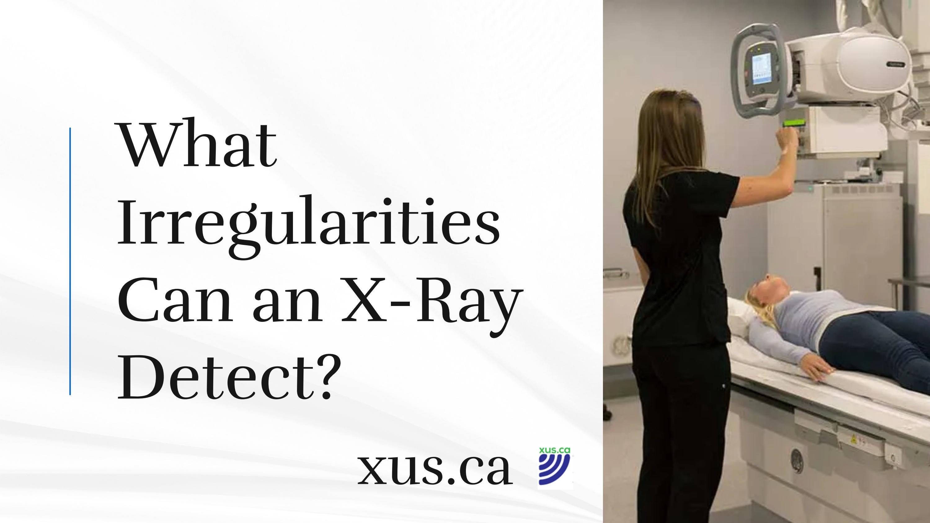 What Irregularities Can an X-Ray Detect? by Toronto East X-ray ...