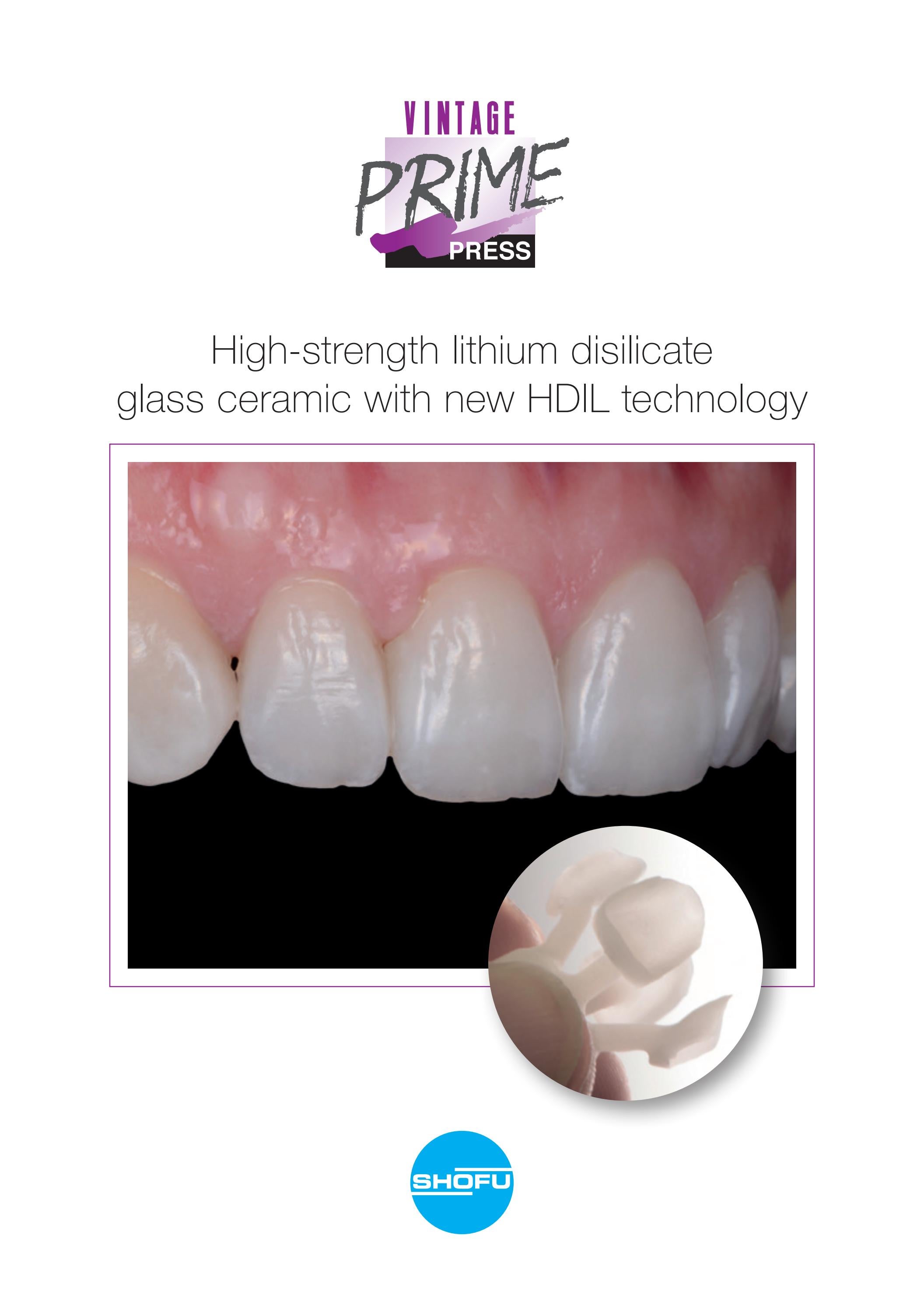 SHOFU Dental: Vintage Prime Press // English by SHOFU Dental GmbH - Issuu