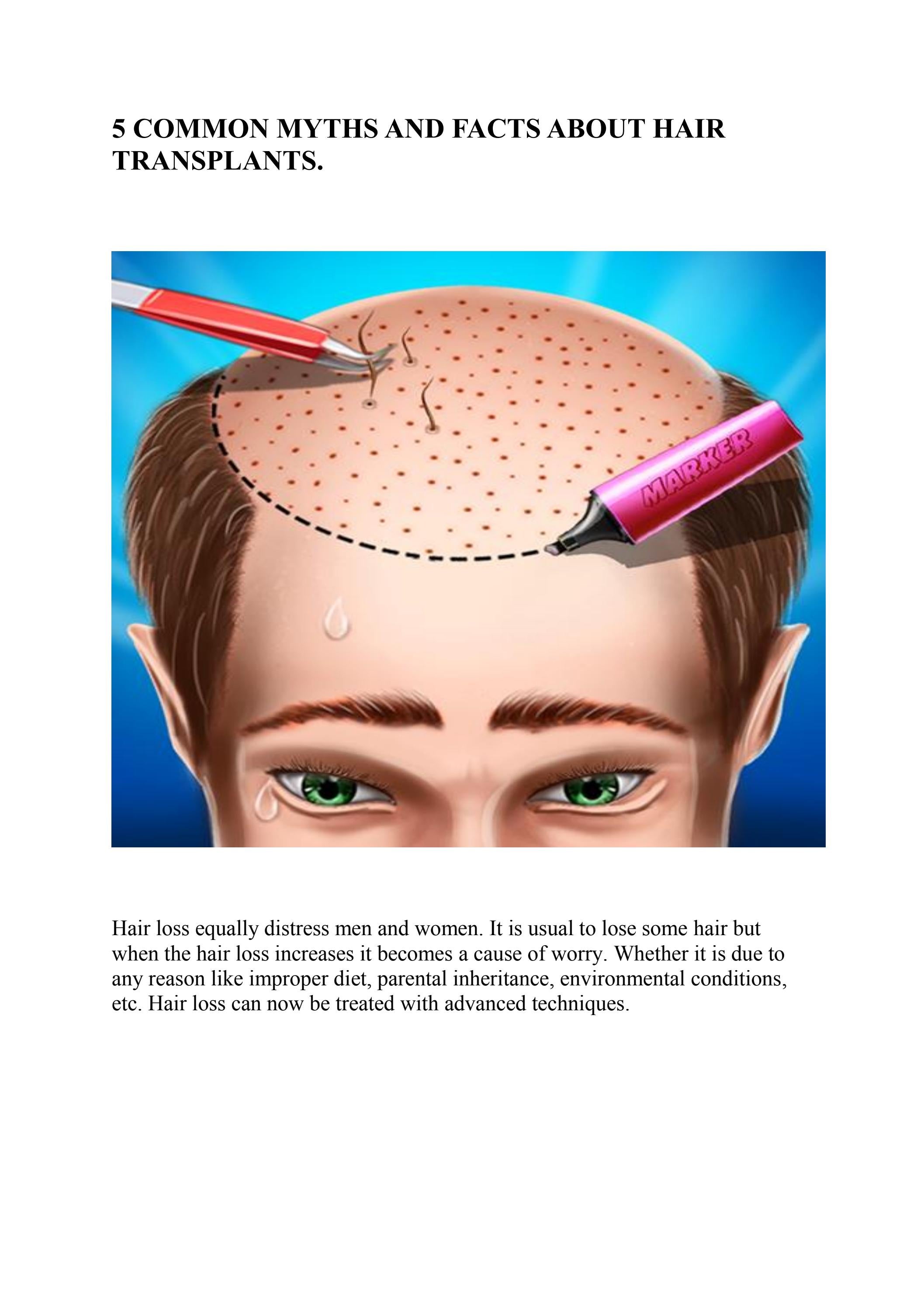 5 Myths About Hair Transplant Which Are Not True By Avenues Kapadia Issuu