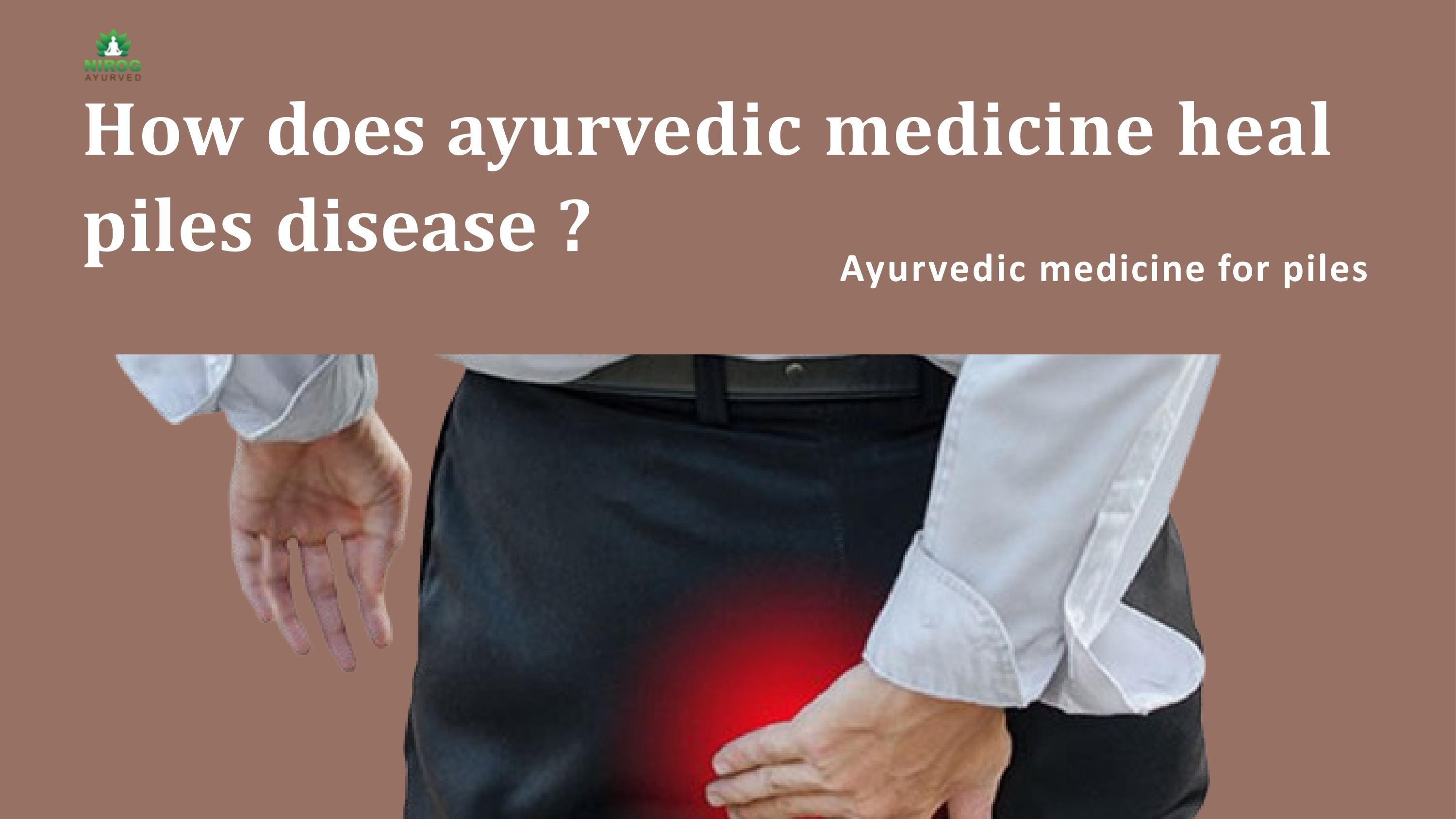 How does ayurvedic medicine heal piles disease? by Arpita Gupta - Issuu