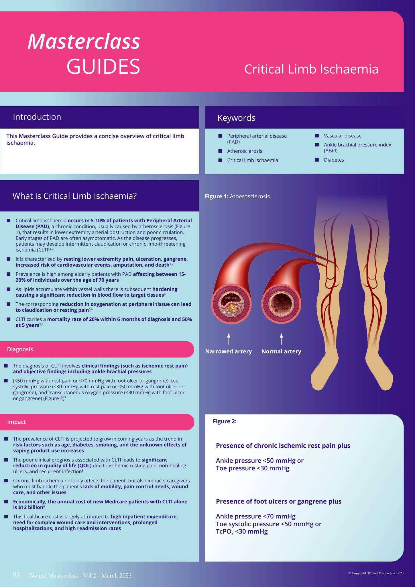 Masterclass Guides: Critical Limb Ischaemia by woundmasterclass - Issuu