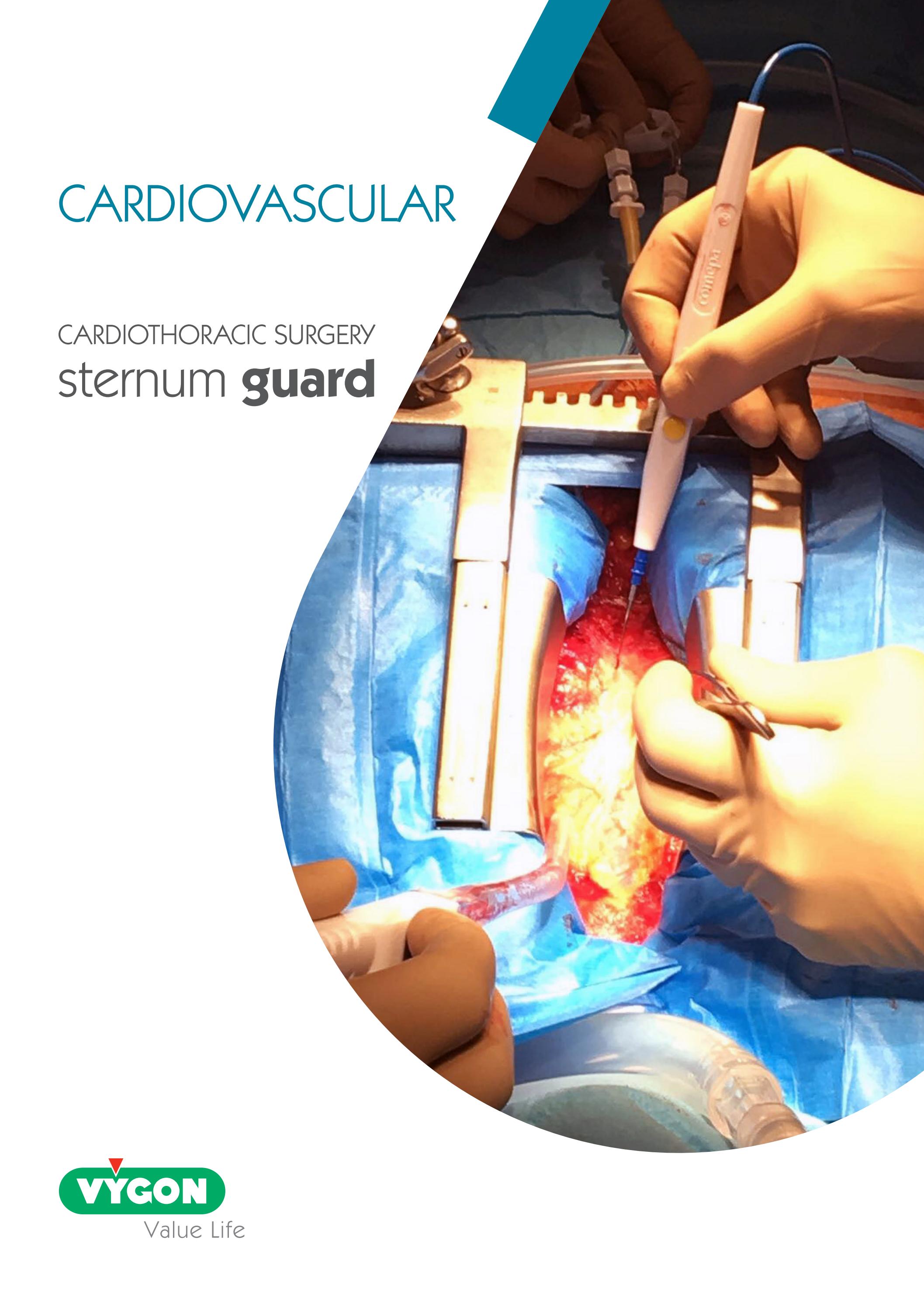Sternum_Guard by VygonGroup - Issuu