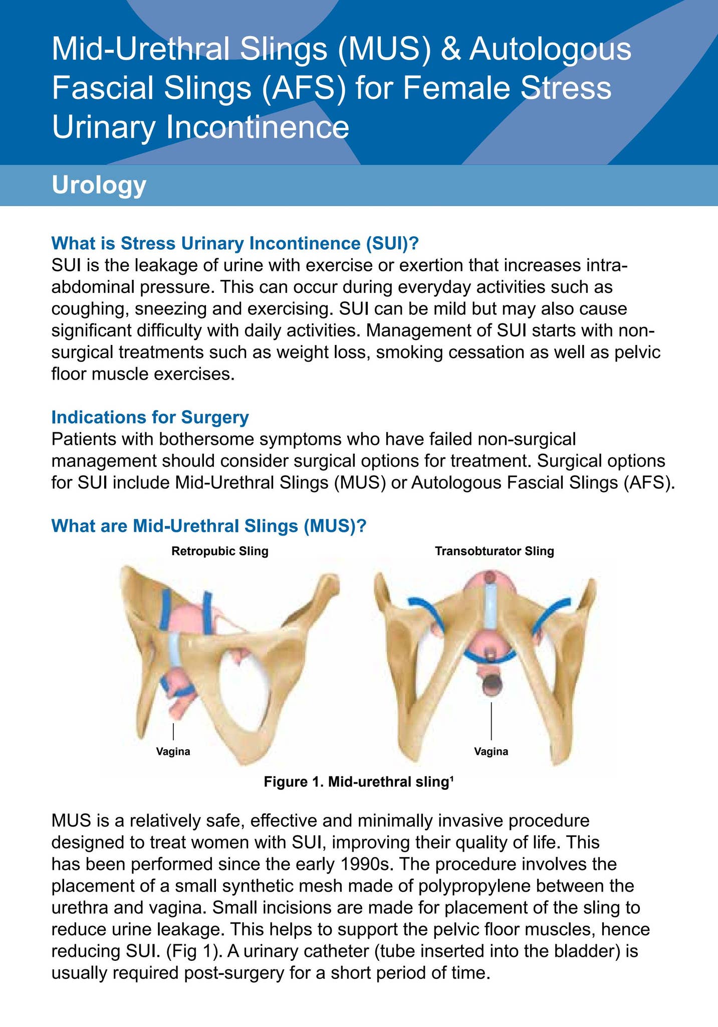 Mid-Urethral Slings (MUS) & Autologous Fascial Slings (AFS) for Female ...