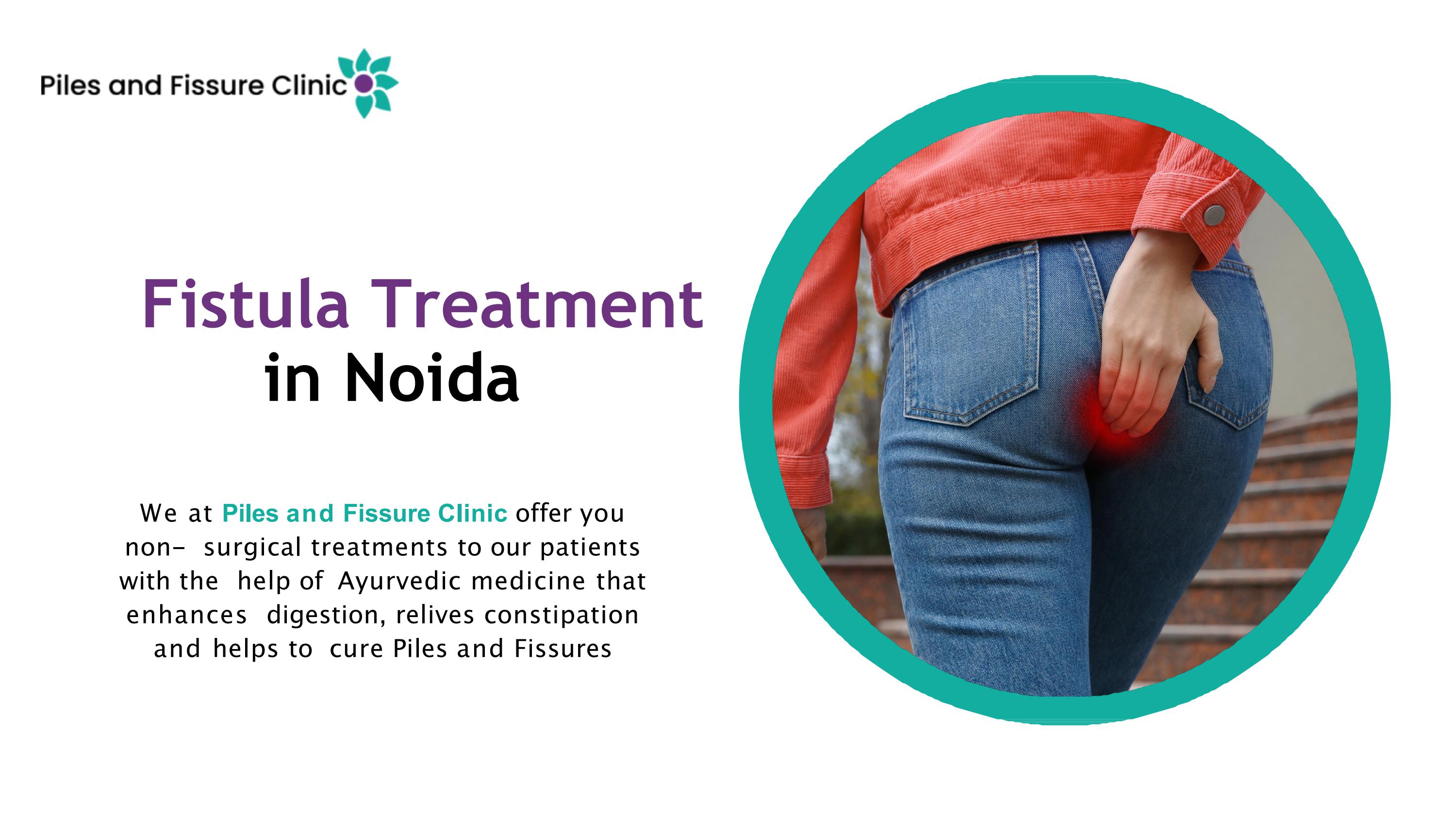 Best Fistula Treatment in Noida by Dr. Anita Rana (Ayurhridayam) - Issuu