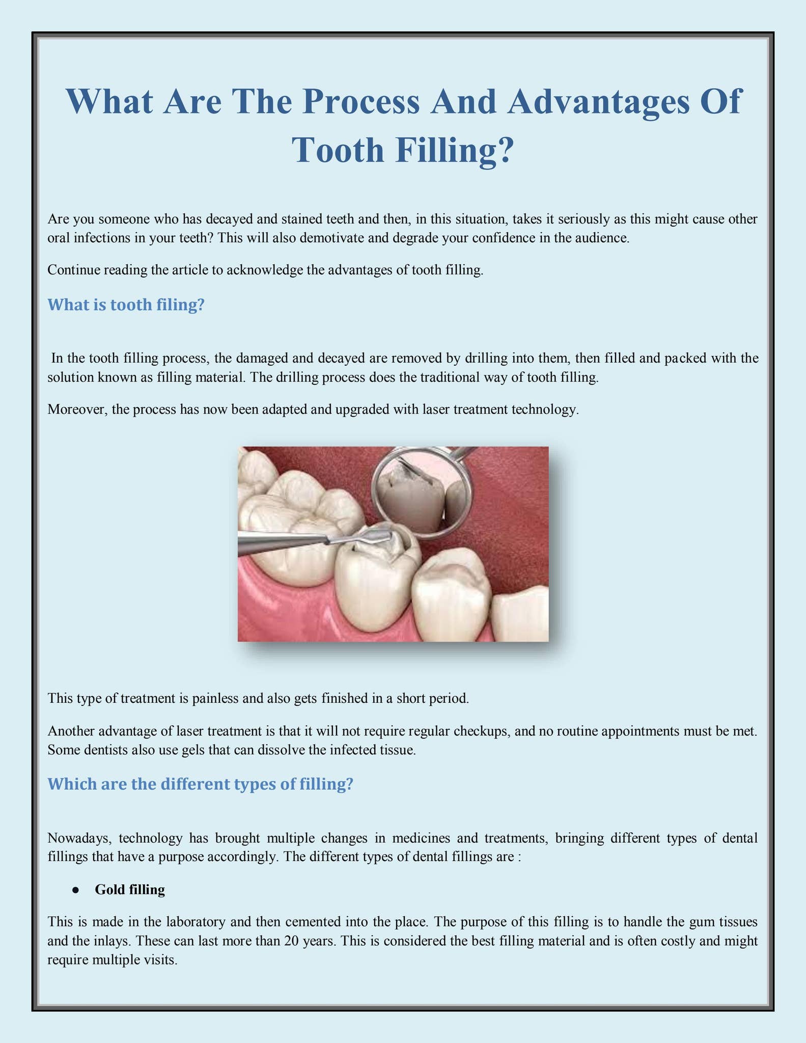 What Are The Process And Advantages Of Tooth Filling? by Emergency ...