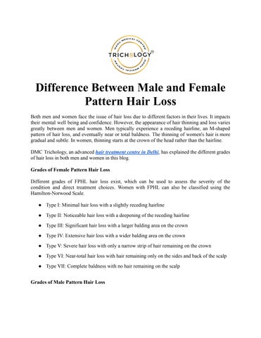 Hair Treatment Centre in Delhi - Difference Between Male and Female ...