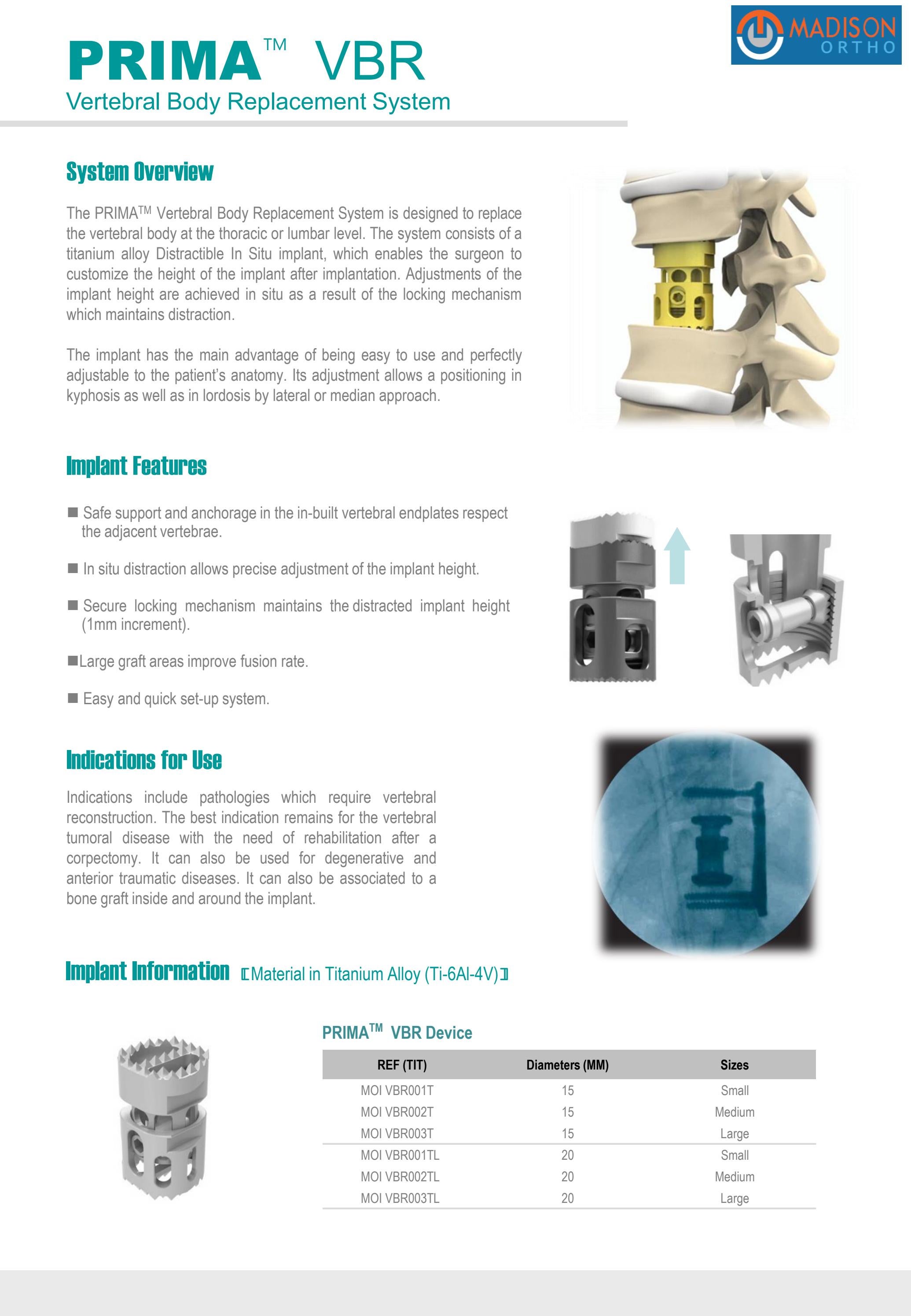 Vertebral Body Replacement System by MadisonOrtho by ...