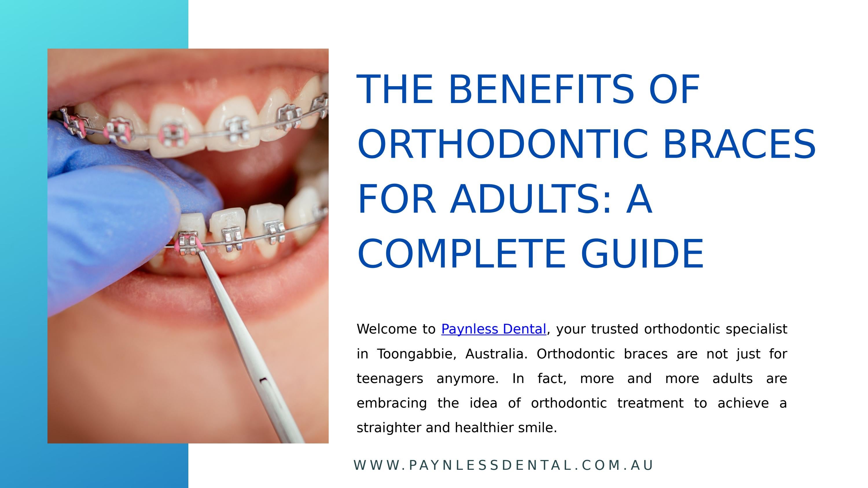 Orthodontic Braces For at Kellie Jackson blog