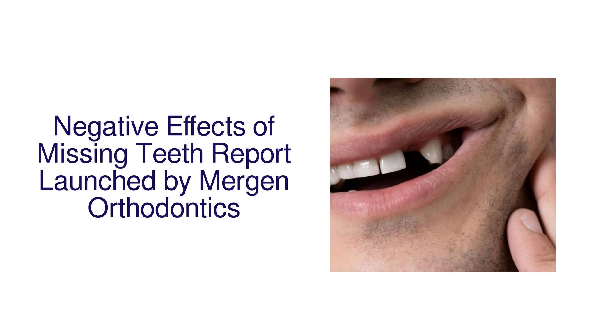 Negative Effects of Missing Teeth Report Launched by Mergen ...