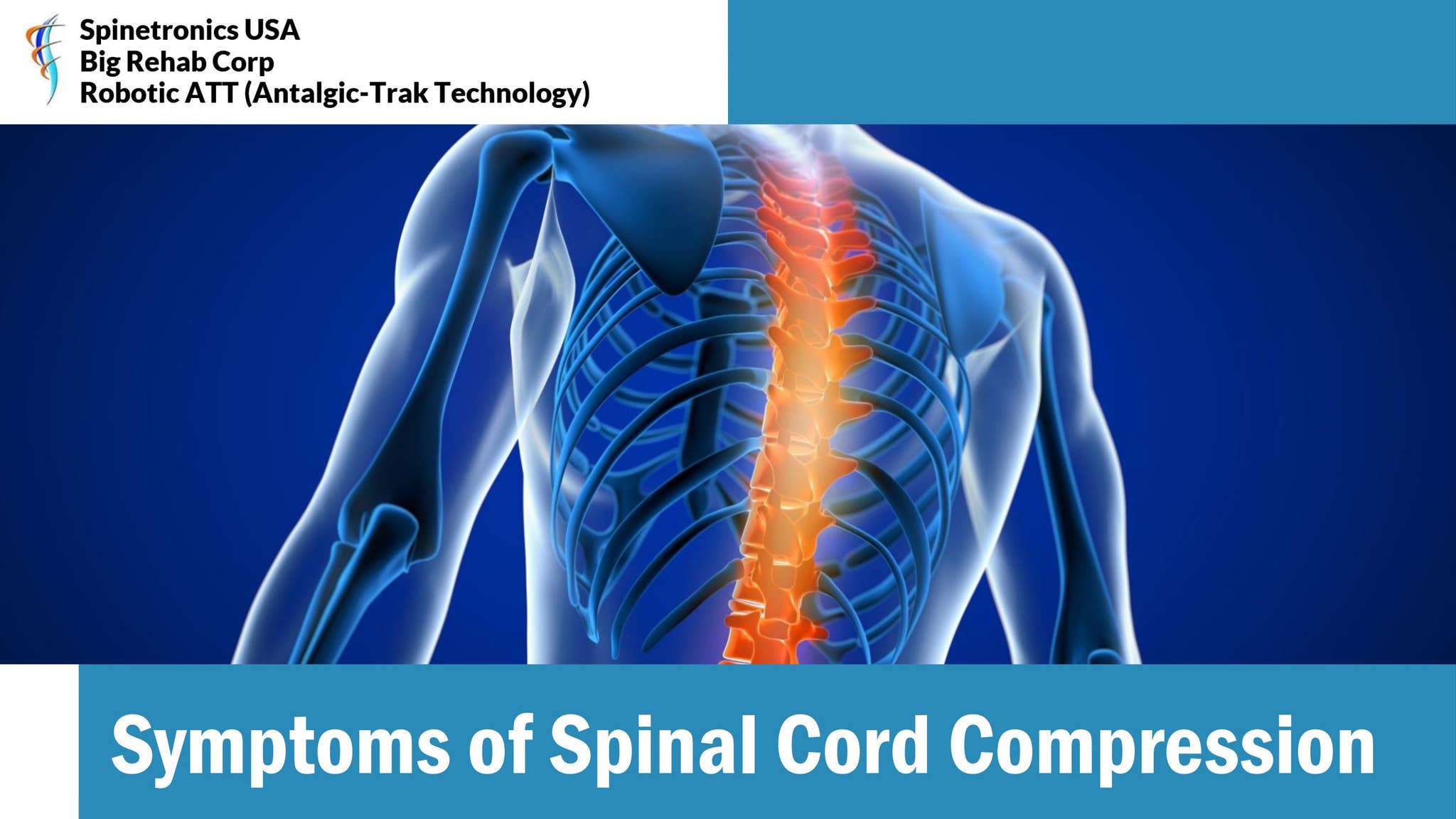 Spinal Cord Compression: Symptoms, Causes, and Relief by Big Rehab Corp ...