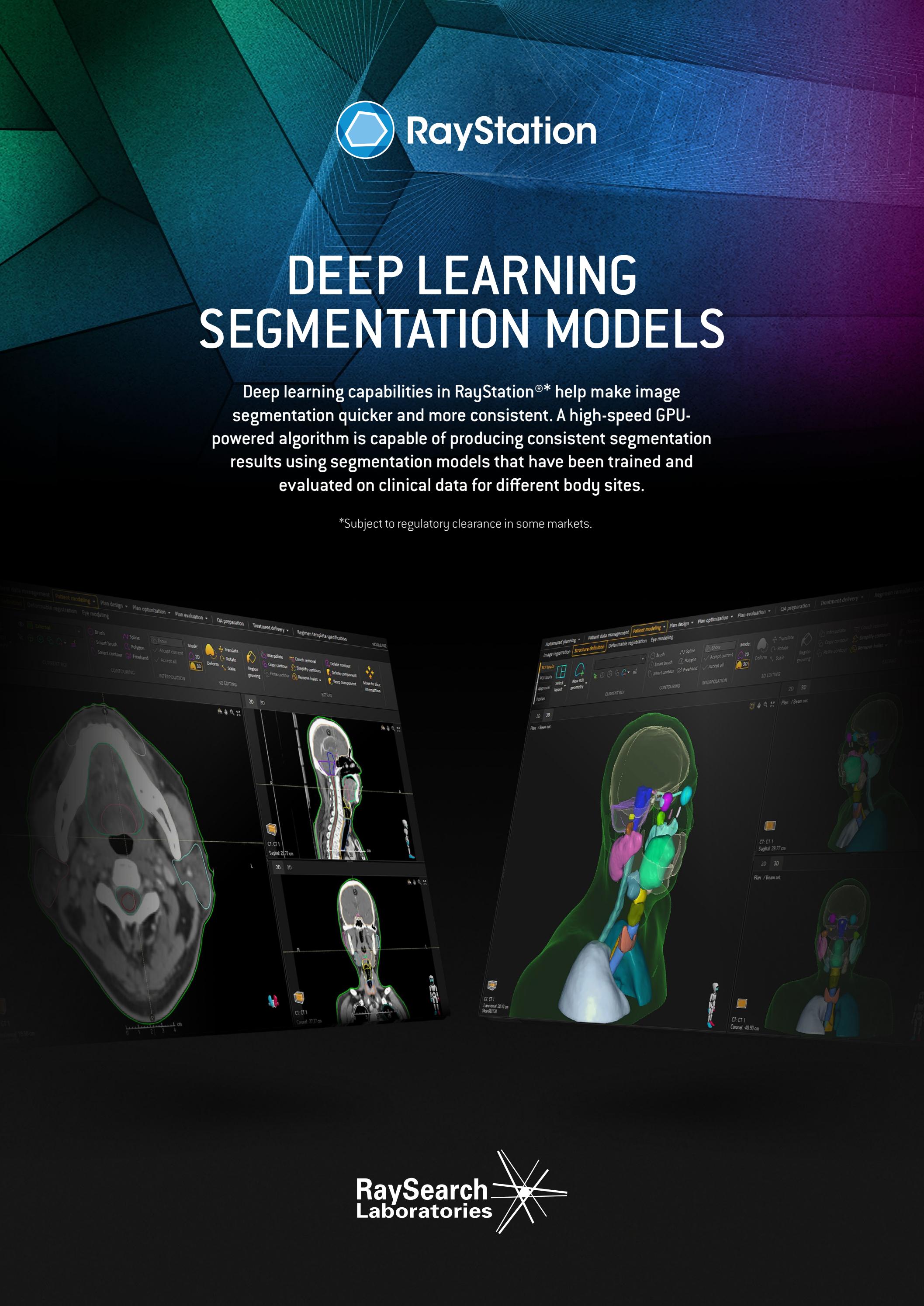 Deep Learning Segmentation model catalogue by RaySearch Laboratories ...