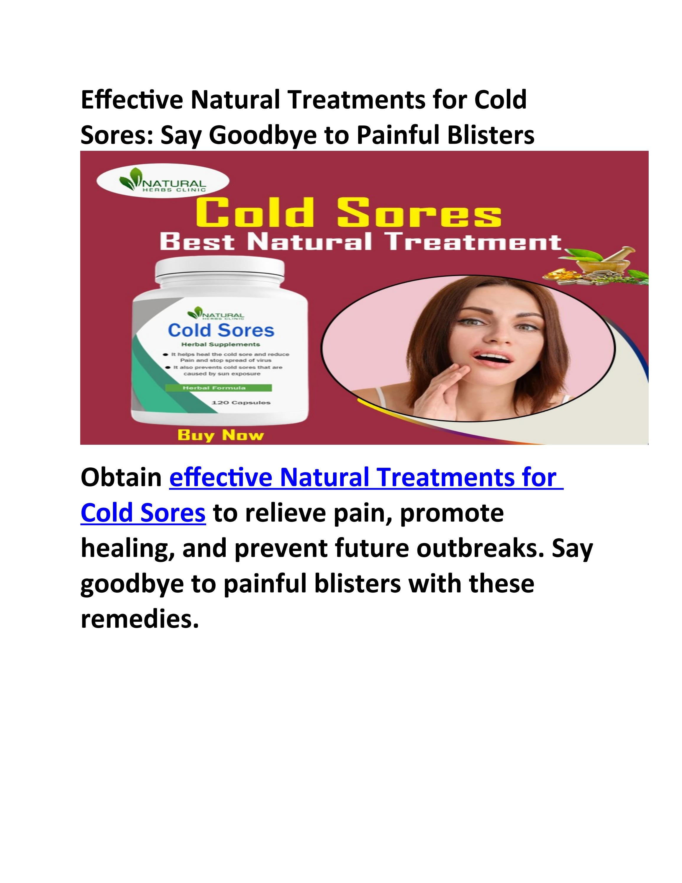 Natural Cold Sore Remedies