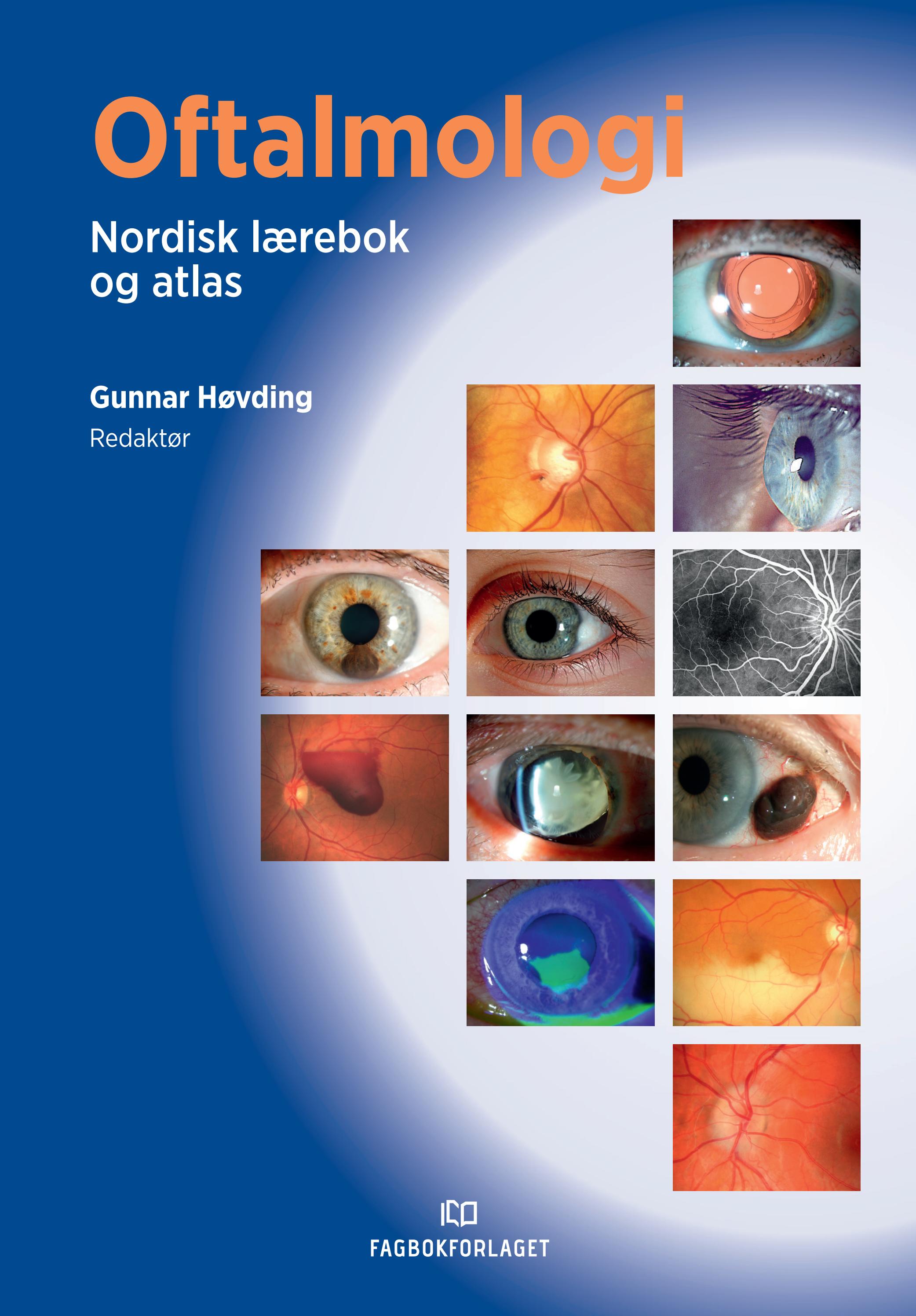 Oftalmologi, 16. utgave (9788245046014) by Fagbokforlaget - Issuu