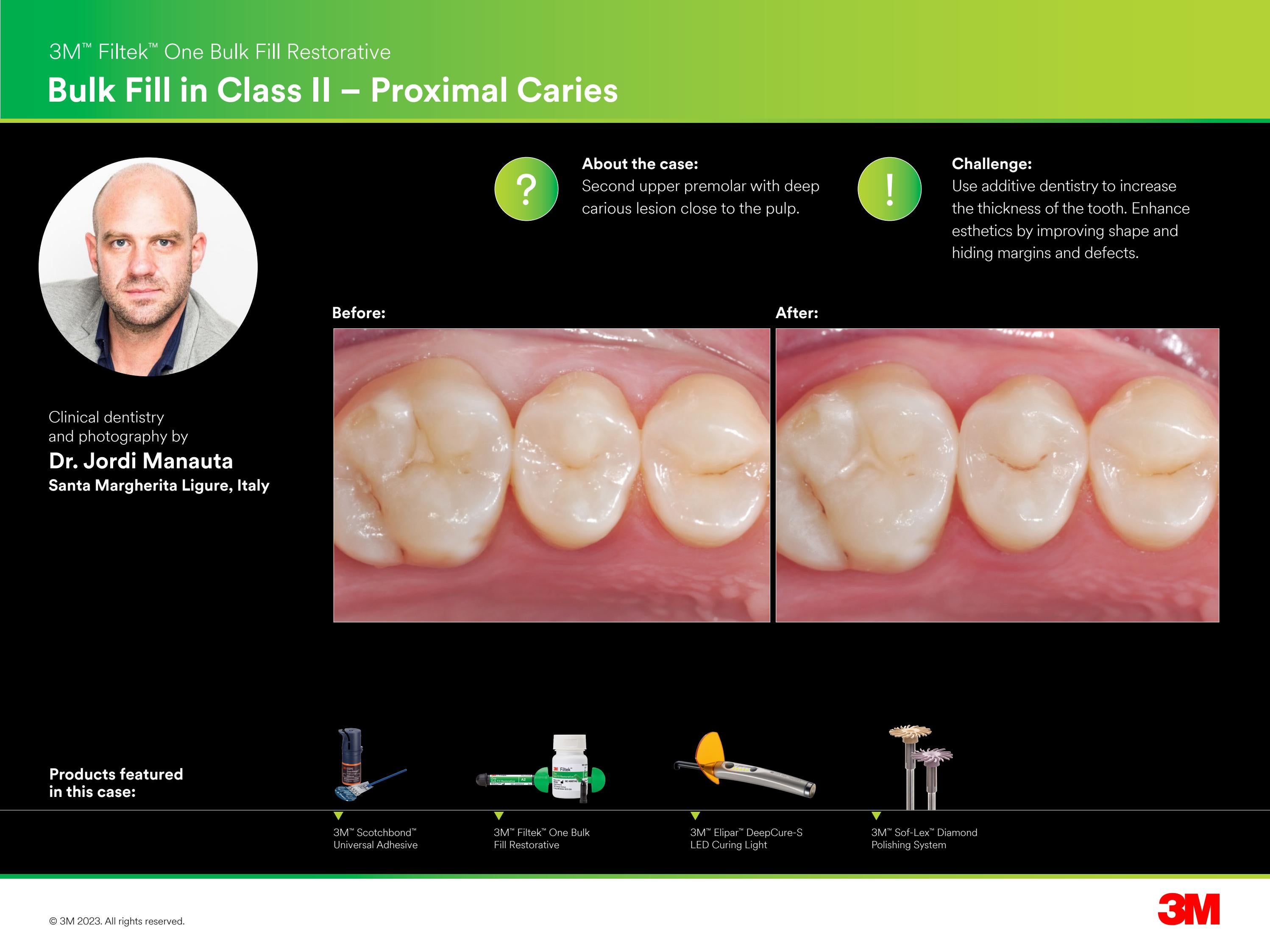 3M Filtek One Bulk Fill Case Study by HenryScheinUK - Issuu
