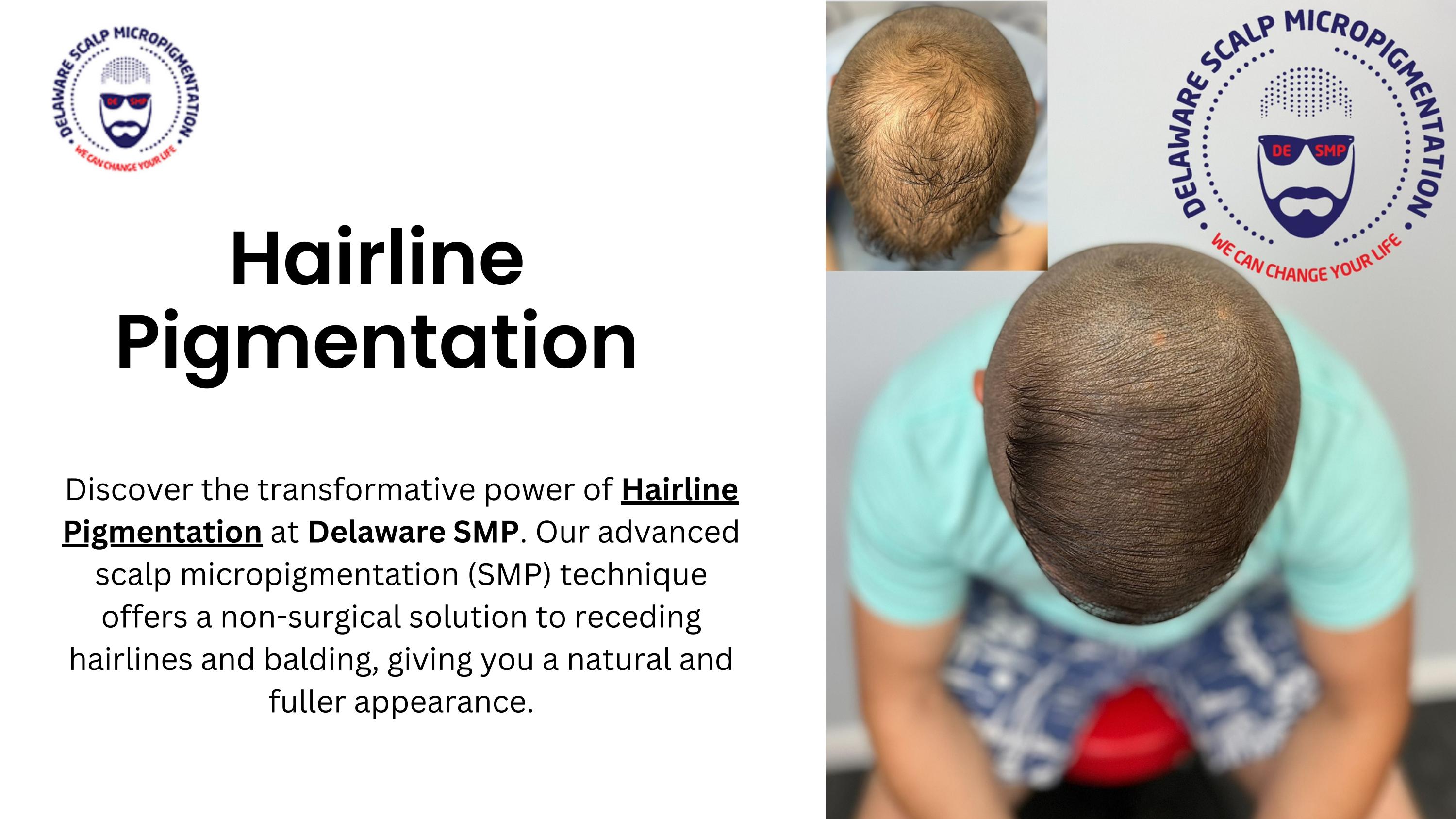Finest Hairline Pigmentation - Delaware SMP by Delaware Scalp ...