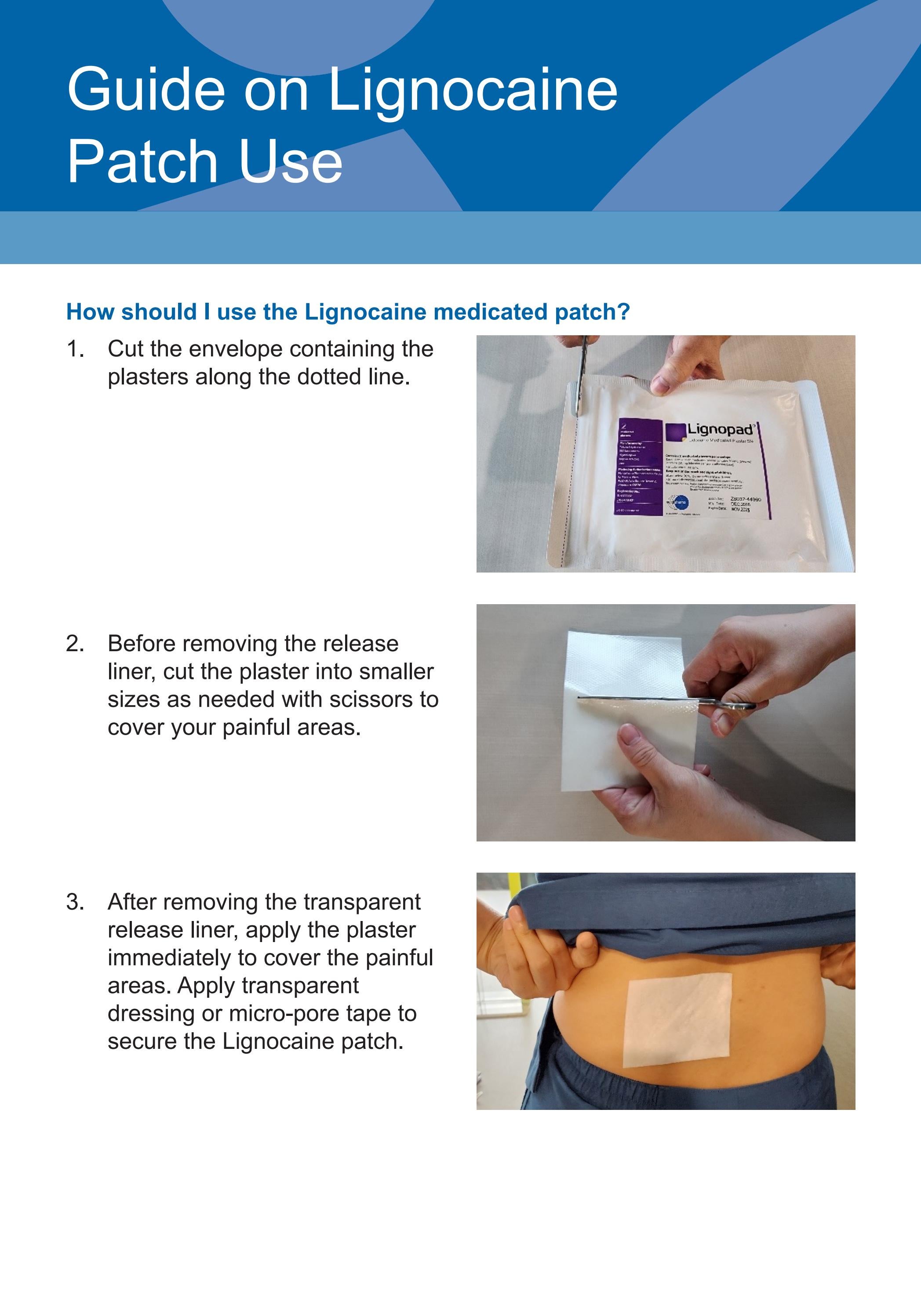 Guide on Lignocaine Patch Use by Yishun Health - Issuu