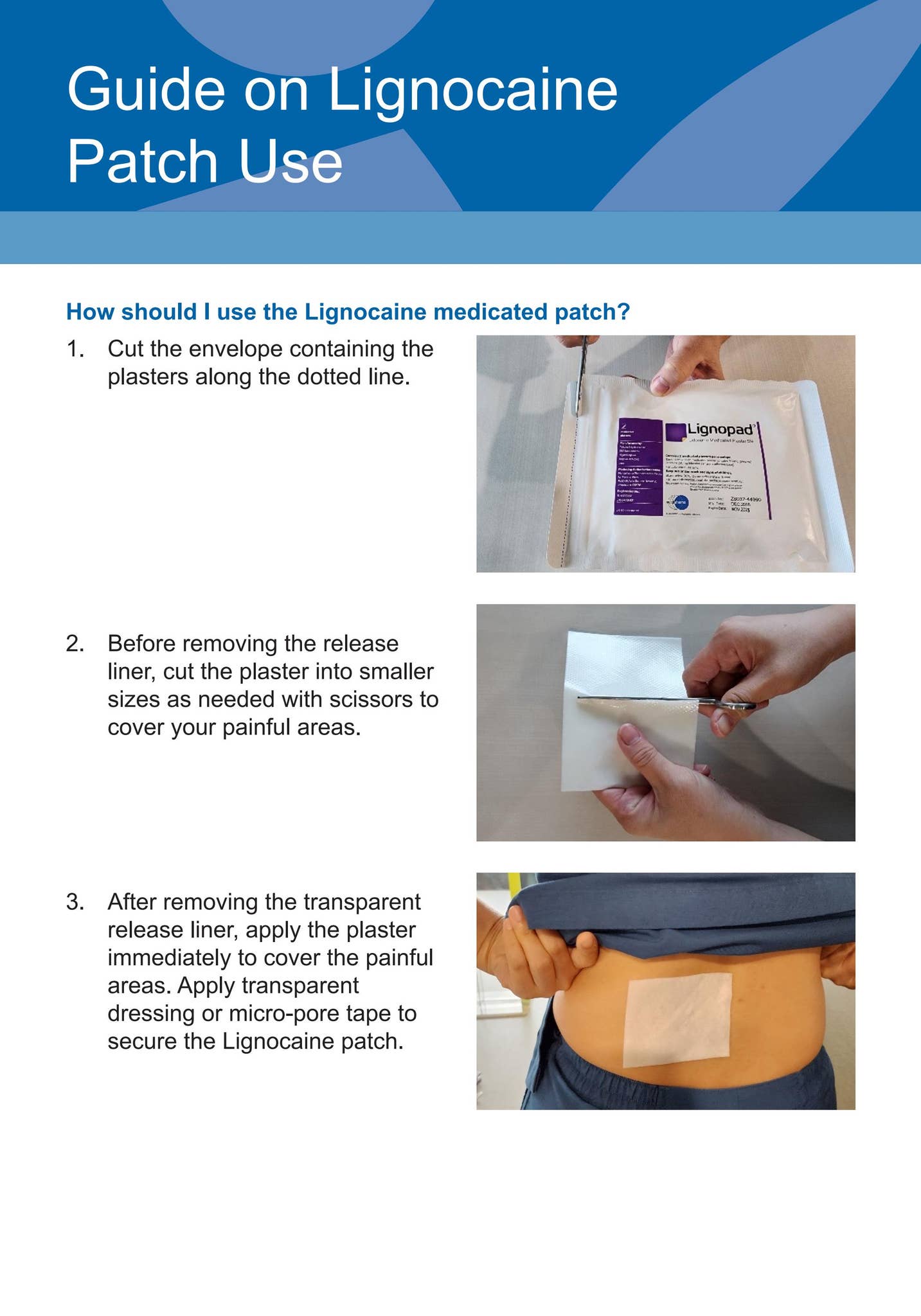 Guide on Lignocaine Patch Use by KTPH_YCH - Issuu