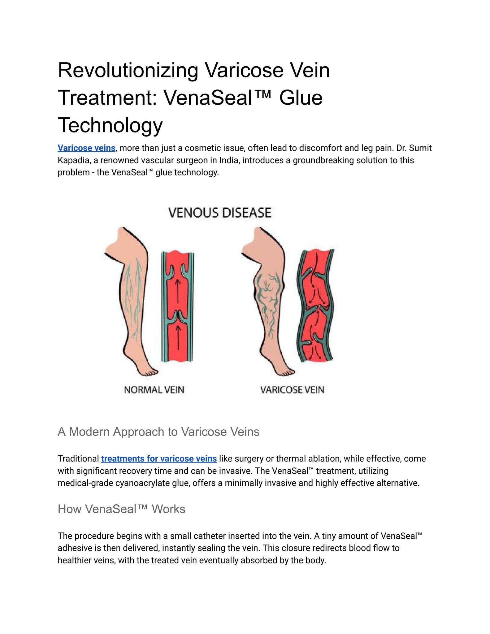 Revolutionizing Varicose Vein Treatment: VenaSeal™ Glue Technology by ...