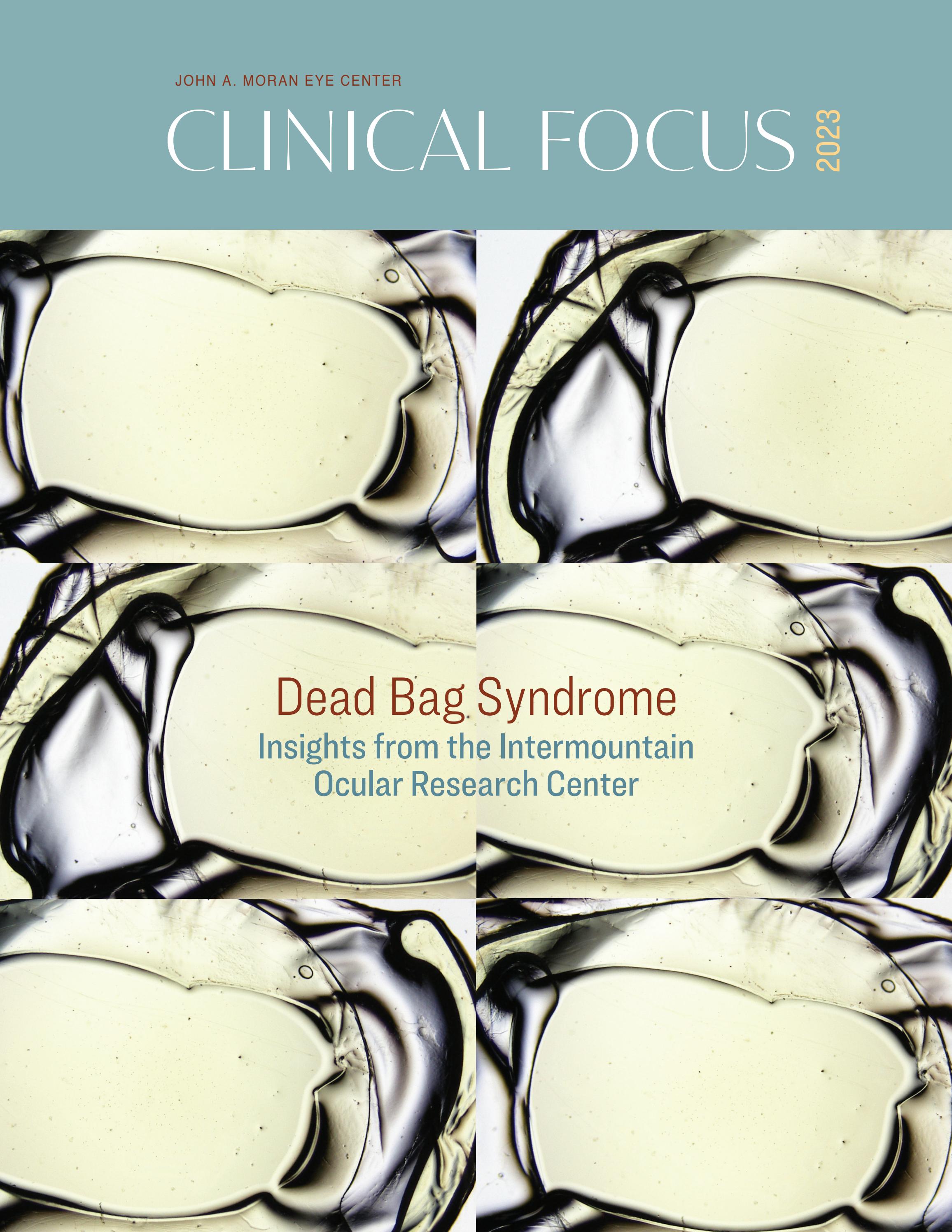 John A. Moran Eye Center Clinical Focus 2023 by John A. Moran Eye ...