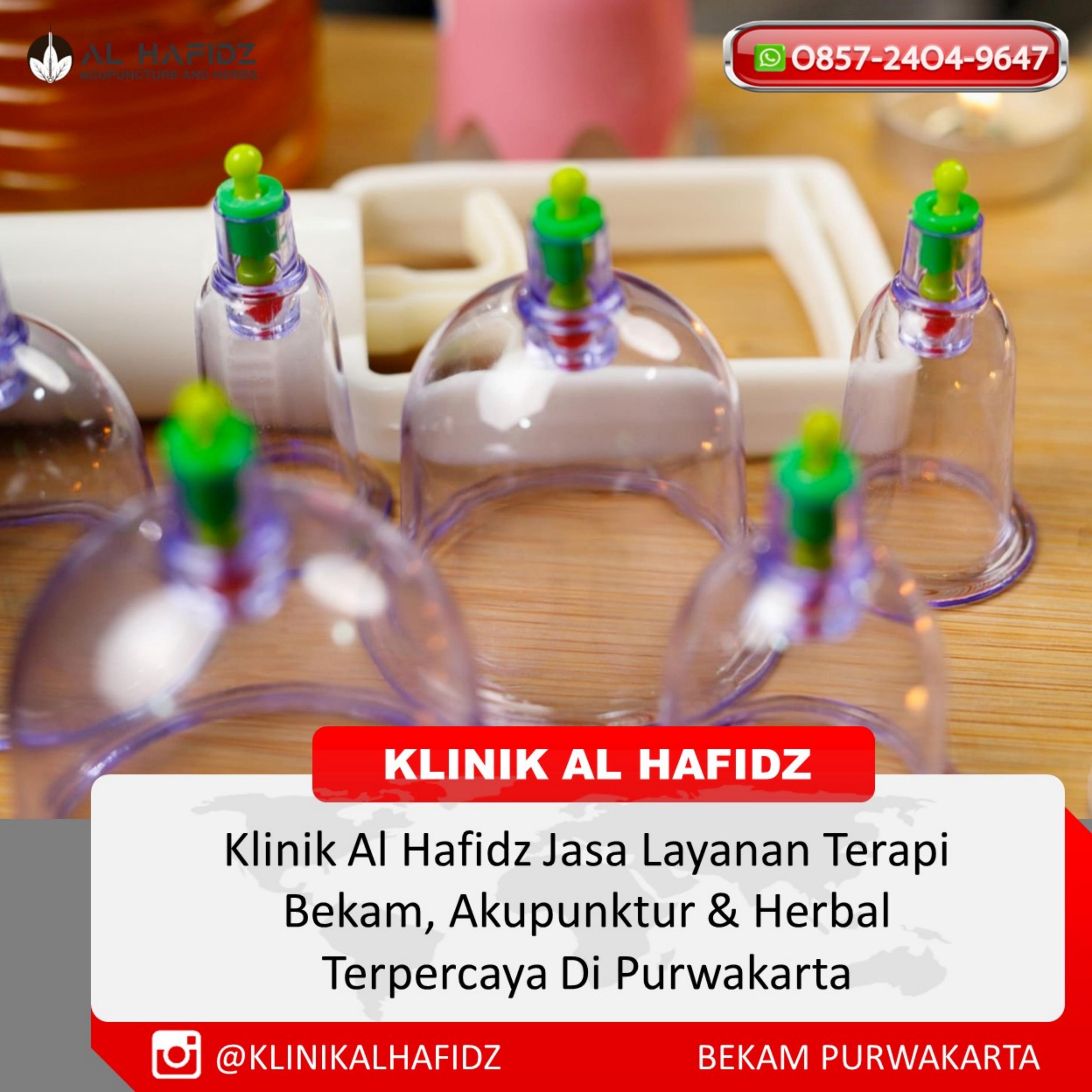0857-2404-9647 Ahli Terapi Bekam Di Campaka Purwakarta by izaryofficial ...