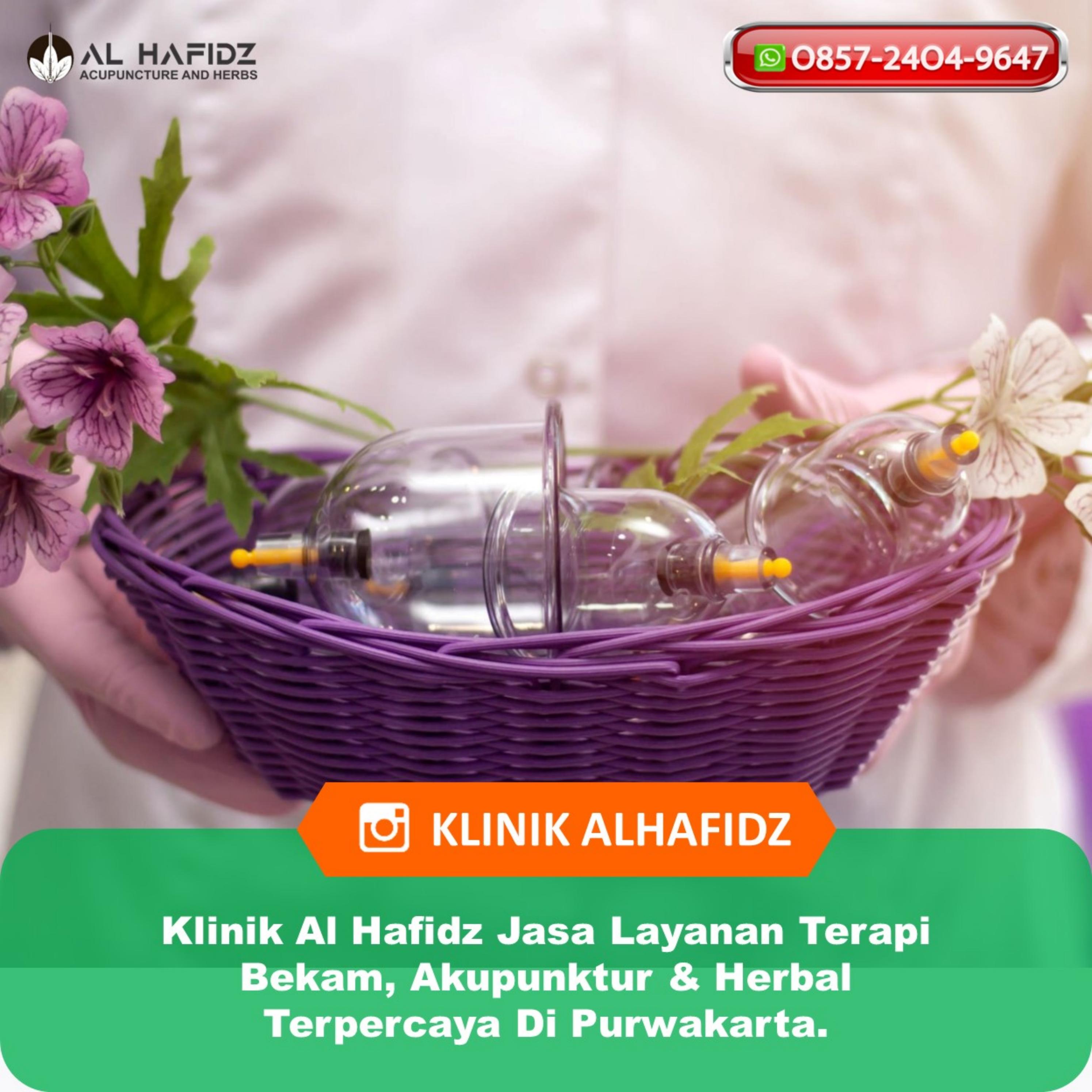 0857-2404-9647 Klinik Terapi Bekam Di Campaka Purwakarta by ...