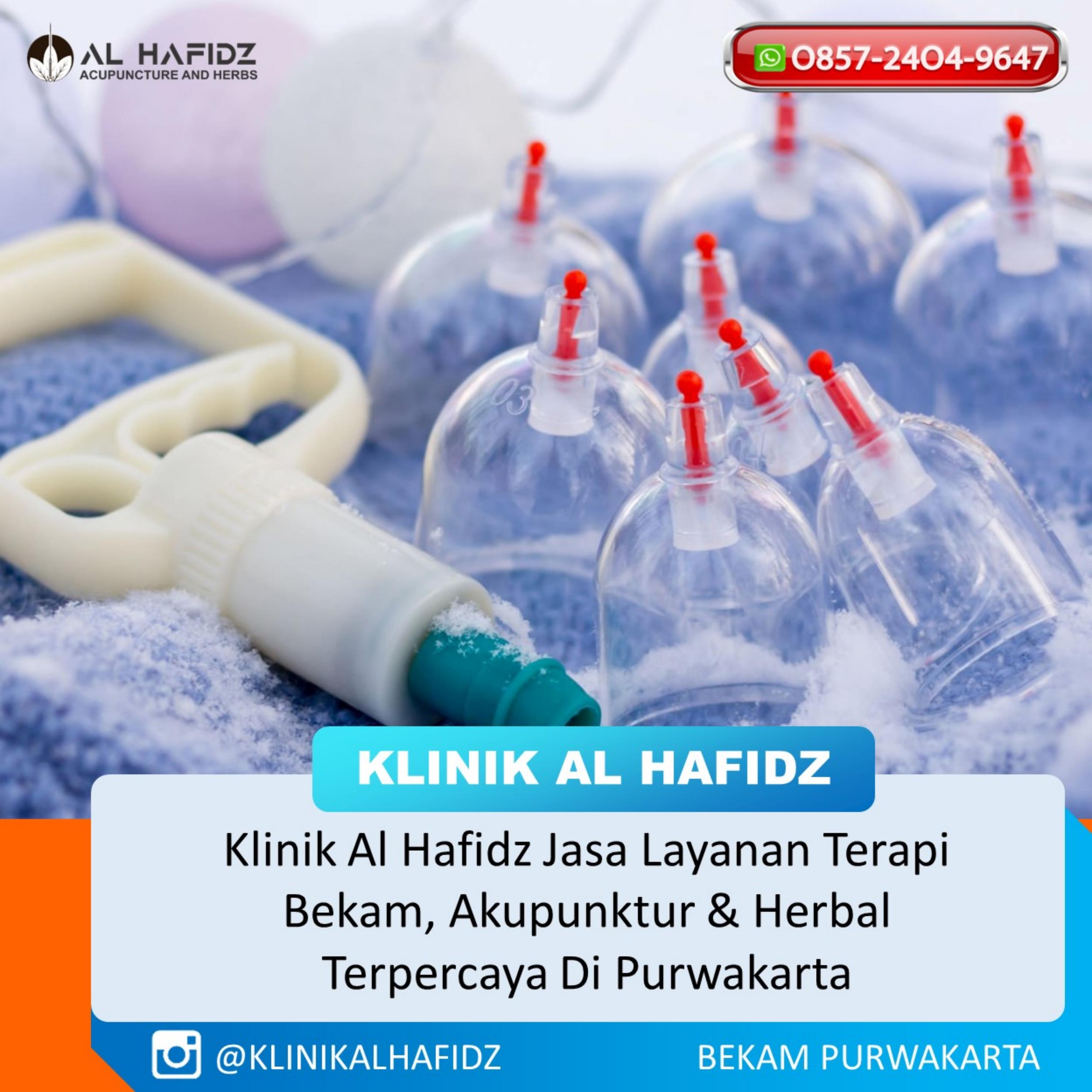 0857-2404-9647 Layanan Terapi Bekam Di Jatiluhur Purwakarta by ...