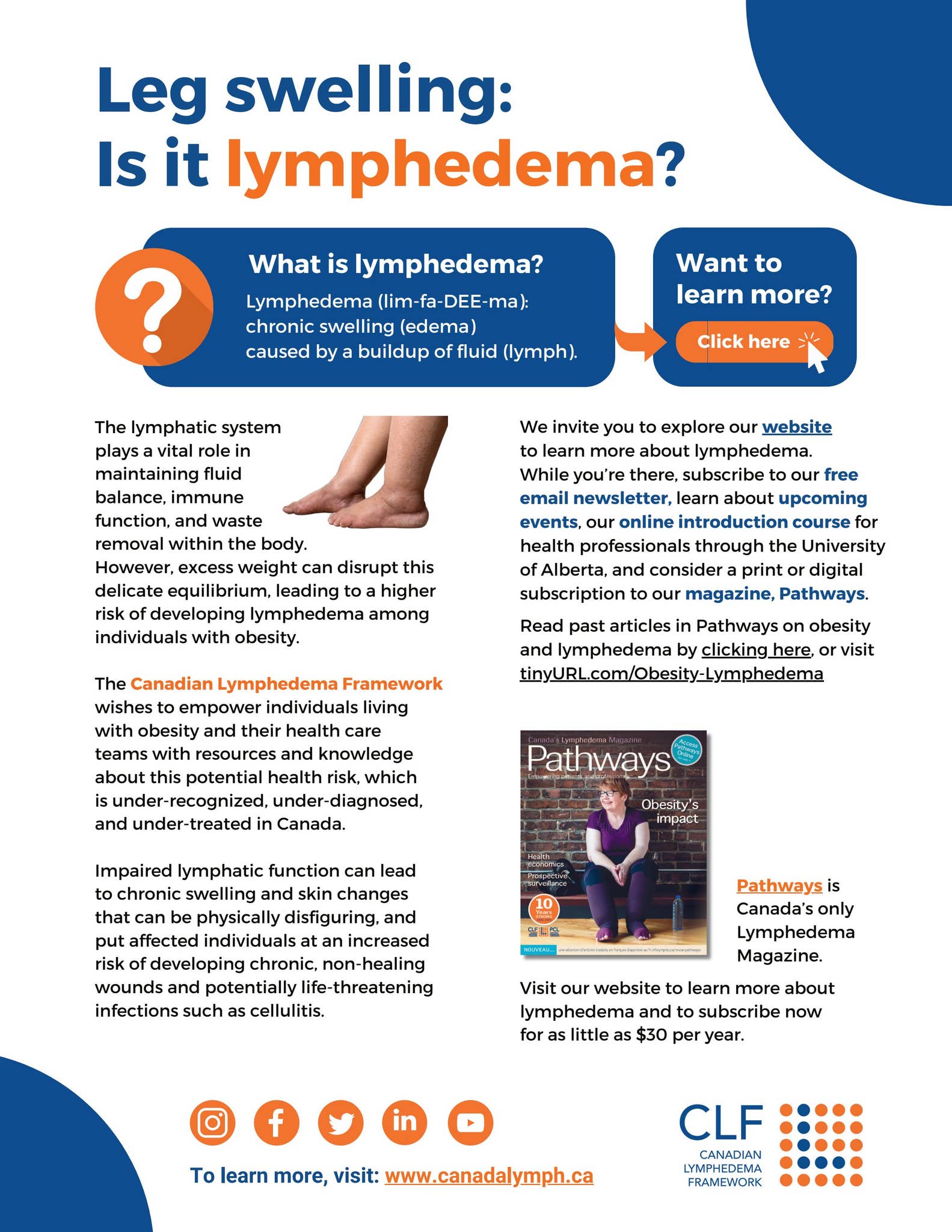 Leg Swelling - Is it Lymphedema? by Canadian Lymphedema Framework - Issuu