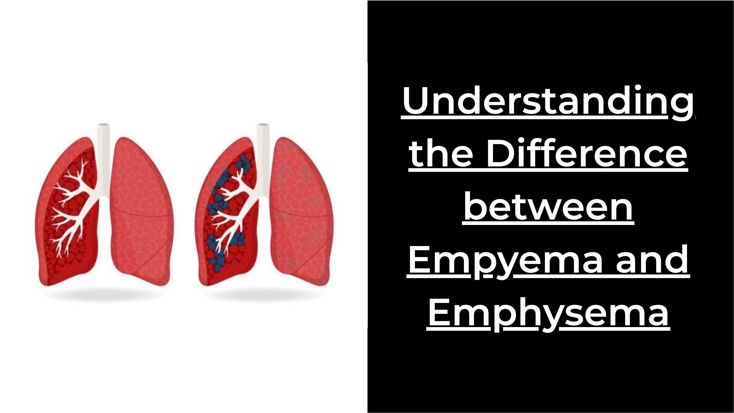Understanding the Difference between Empyema and Emphysema by Dr ...