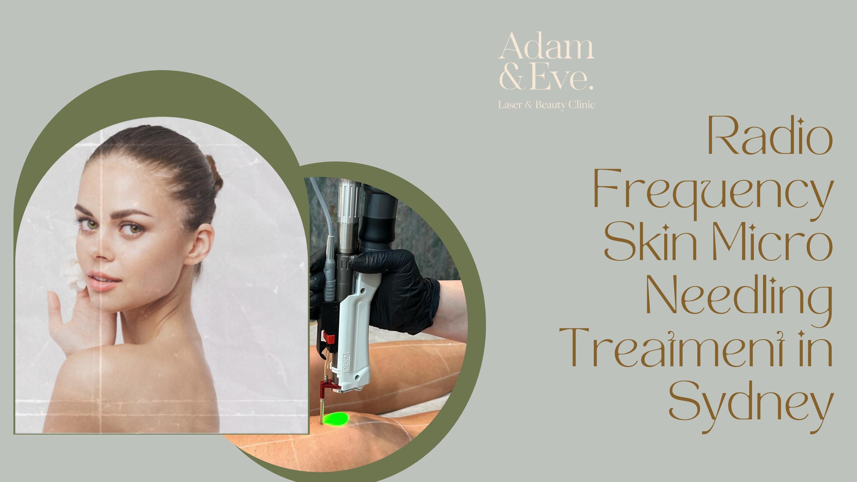 Radio Frequency Skin Micro Needling Treatment in Sydney by Adam and Eve ...
