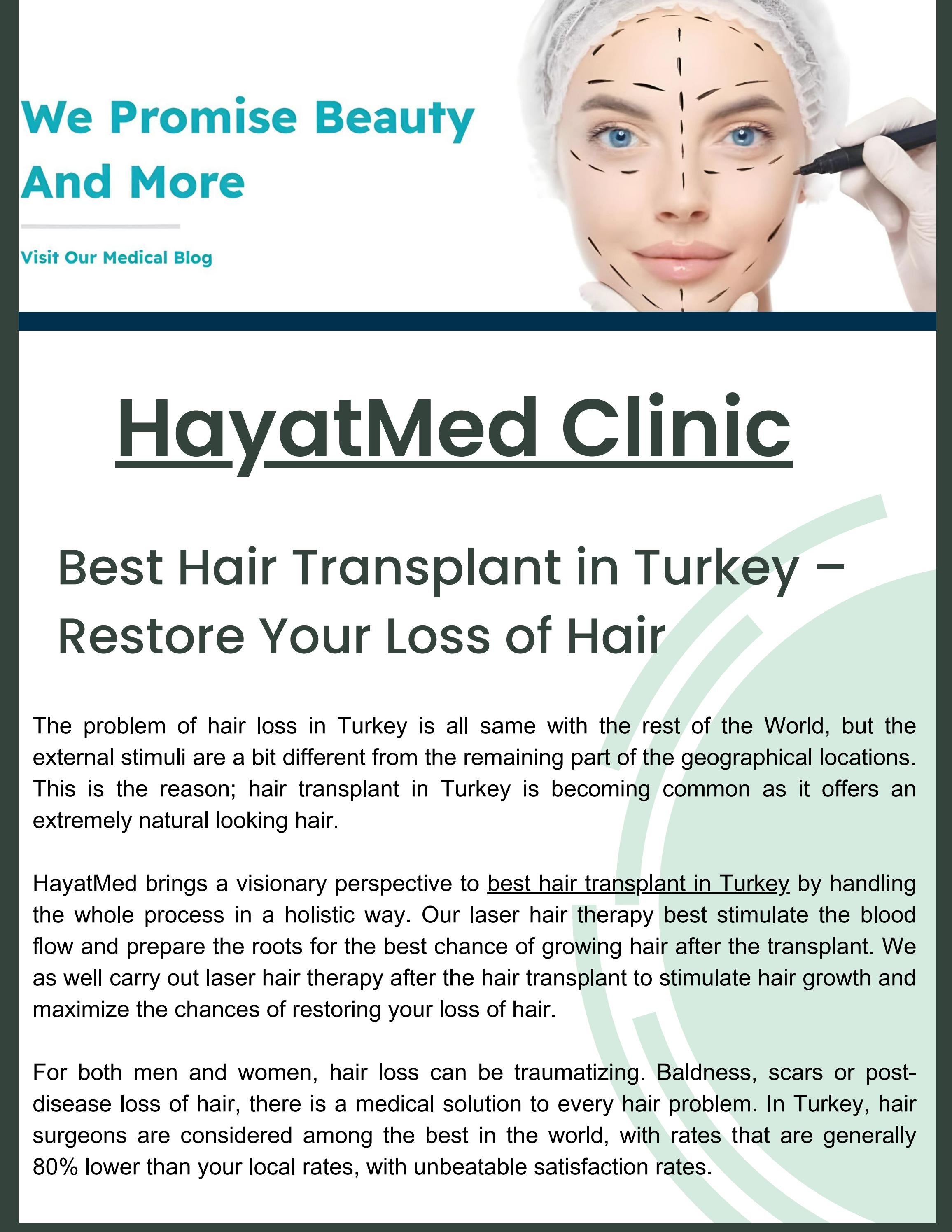 Best Hair Transplant in Turkey – Restore Your Loss of Hair by HayatMed ...