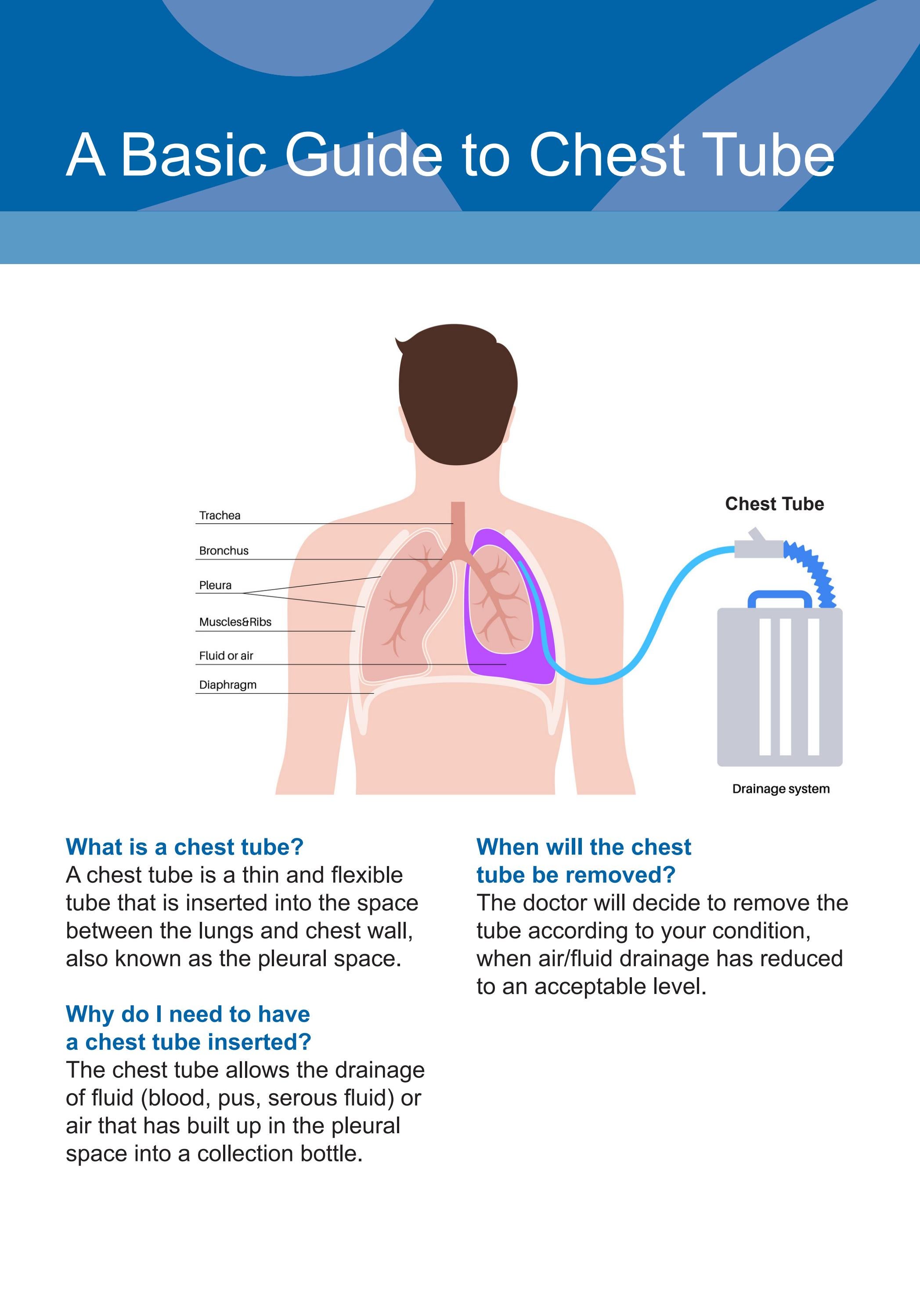 A Basic Guide to Chest Tube by Yishun Health - Issuu