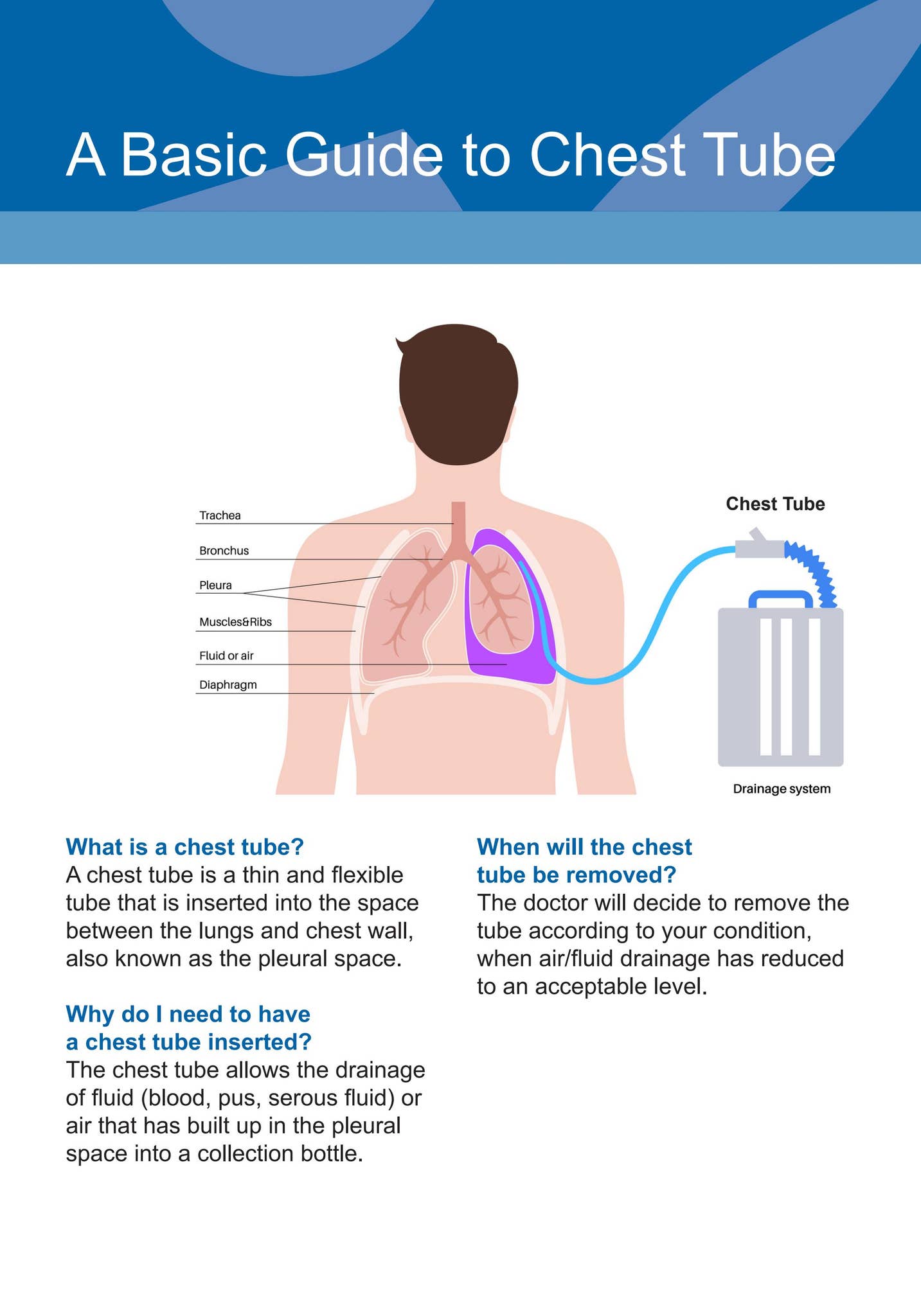 A Basic Guide to Chest Tube by KTPH_YCH - Issuu