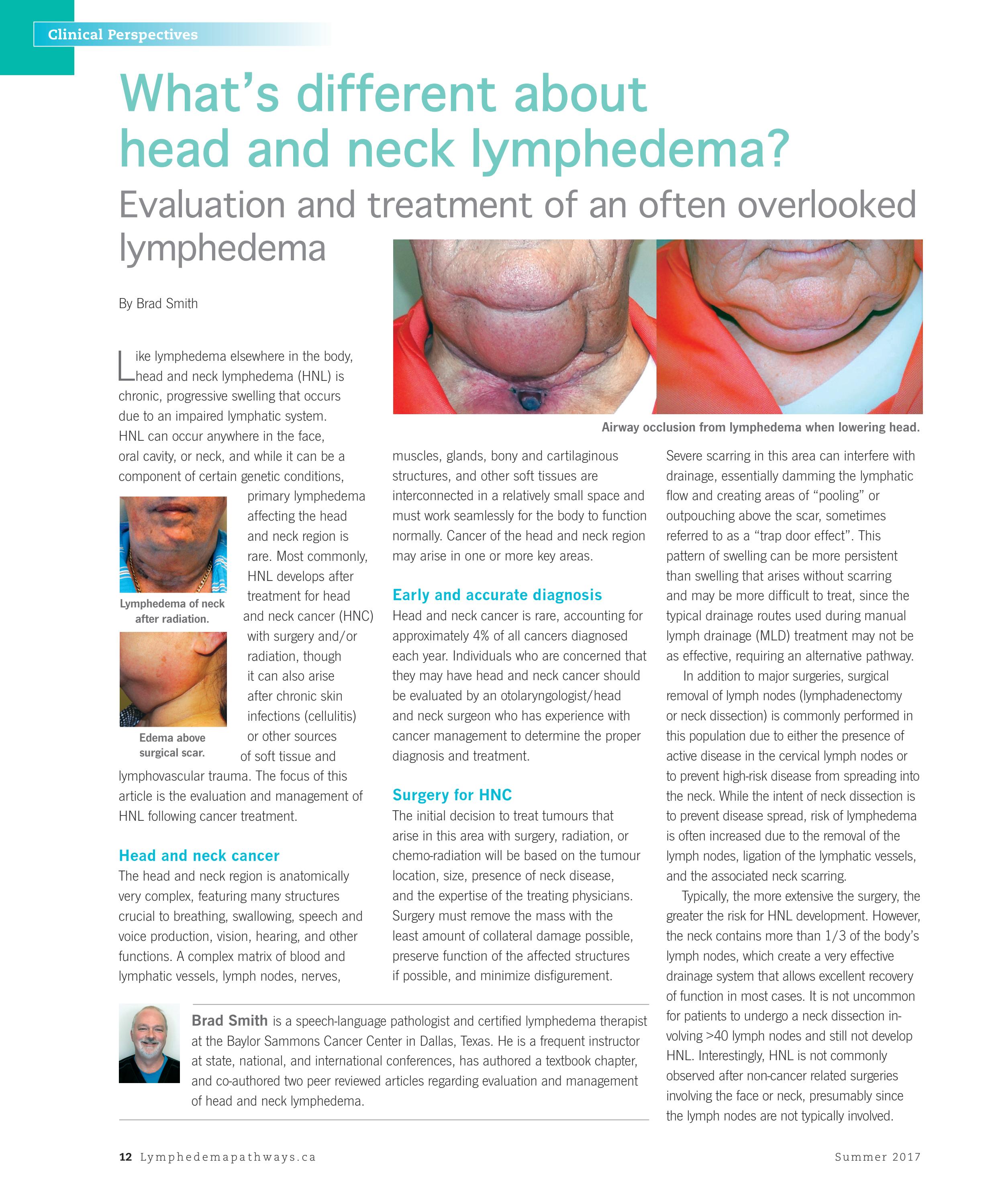 What's different about head and neck lymphedema. B, Smith. by Canadian Lymphedema Framework - Issuu