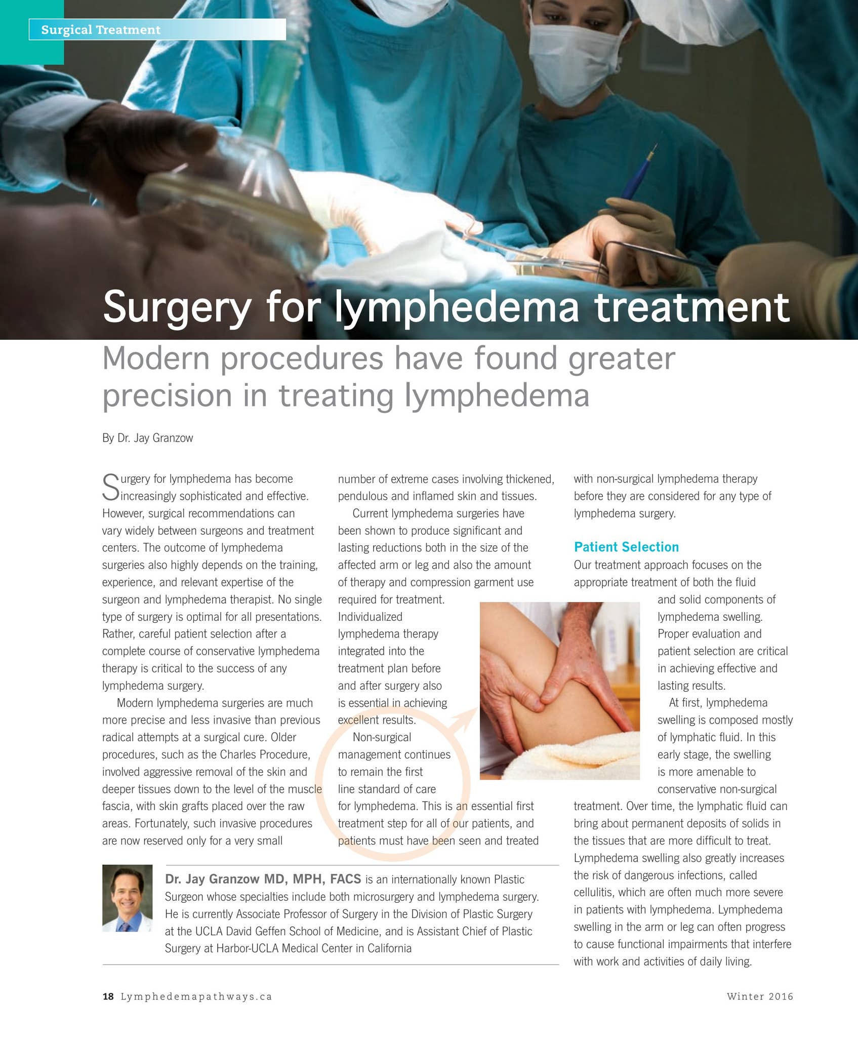 Surgery for lymphedema treatment. by Canadian Lymphedema Framework - Issuu