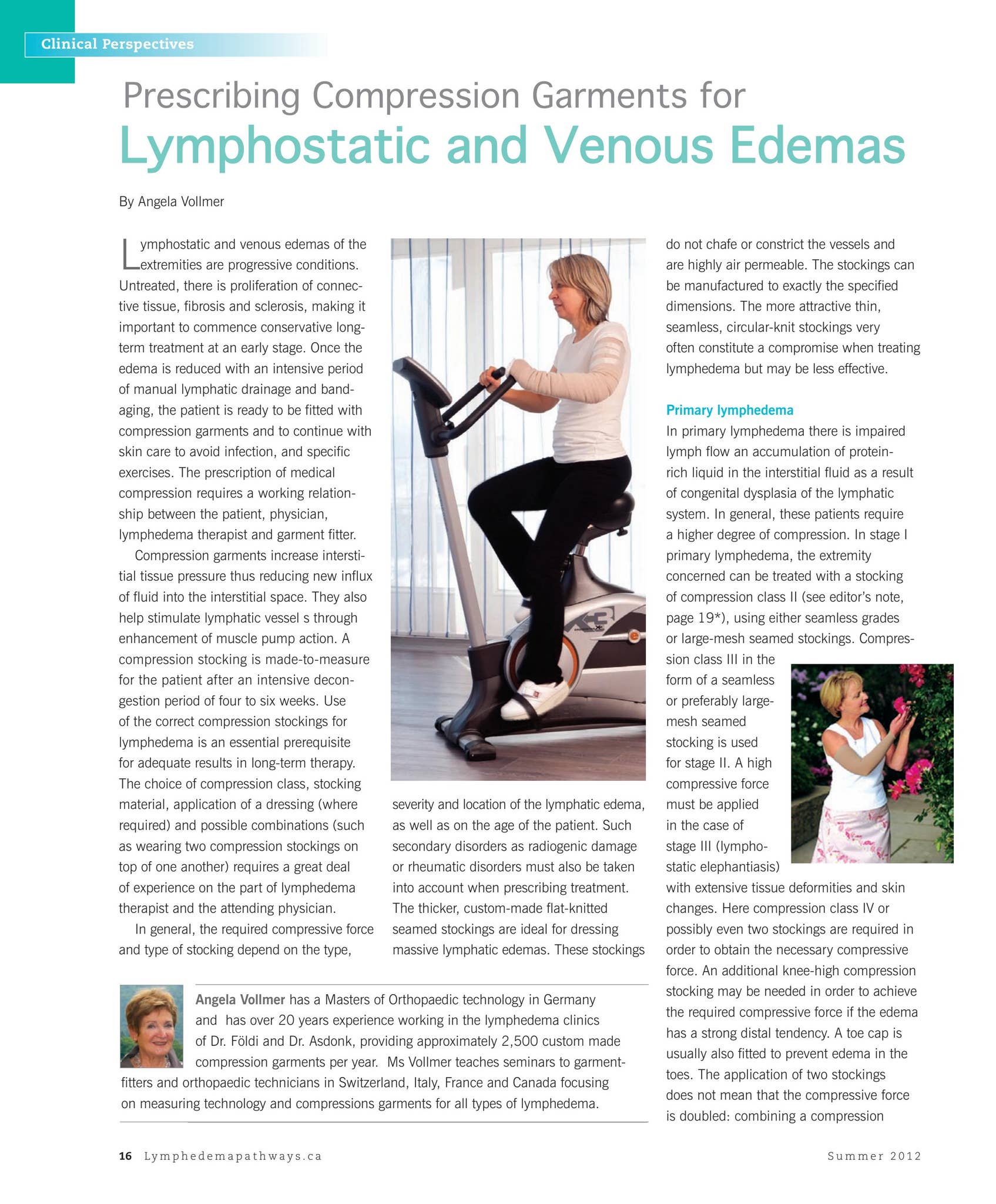 Prescribing Compression Garments for Lymphostatic and Venous Edemas by ...