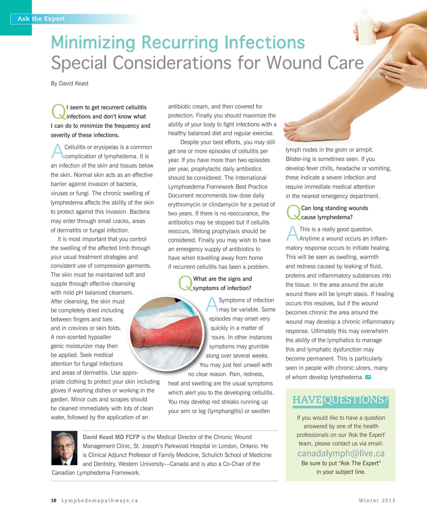 Minimizing Recurring Infections. Special Considerations for Wound Care by Canadian Lymphedema ...