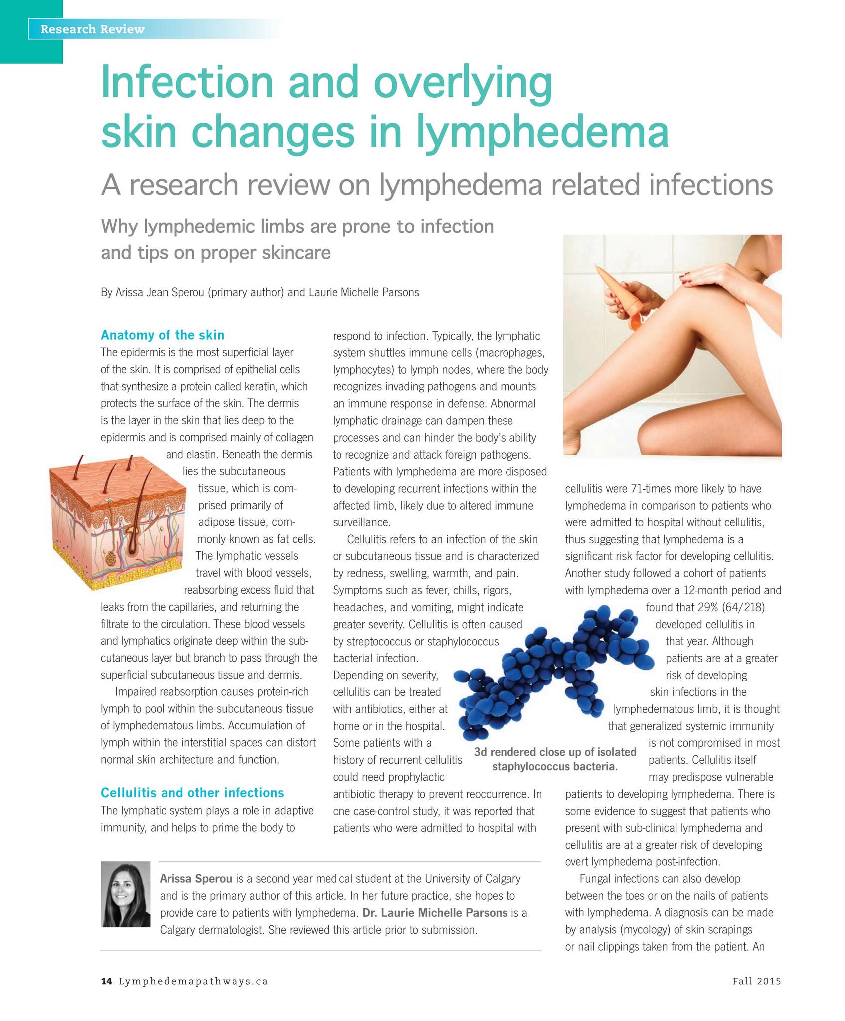 Infection and Overlying Skin Changes in Lymphedema by Canadian Lymphedema Framework - Issuu