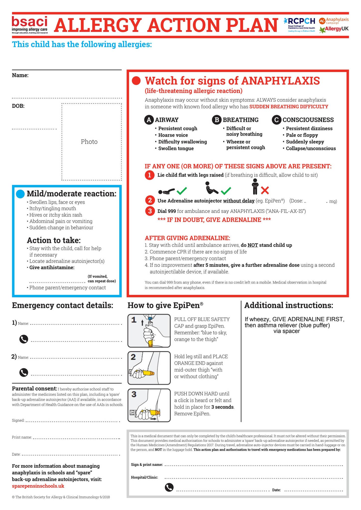 Allergy Action Plan by Roedean School - Issuu