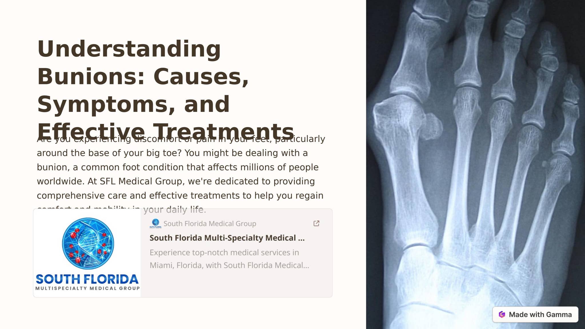 Understanding Bunions: Causes, Symptoms, and Effective Treatments ?? by ...
