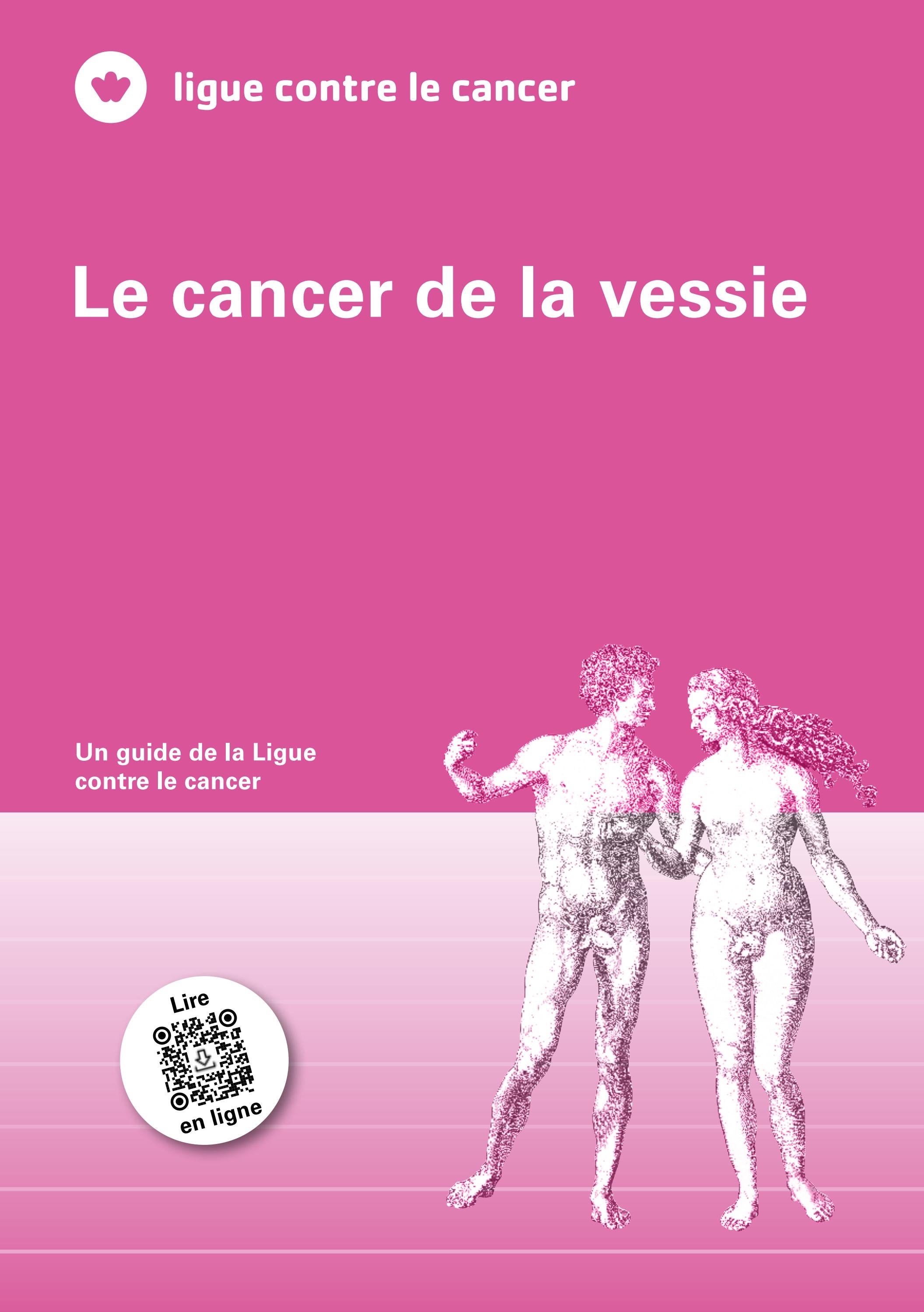 Le cancer de la vessie by Krebsliga Schweiz - Issuu