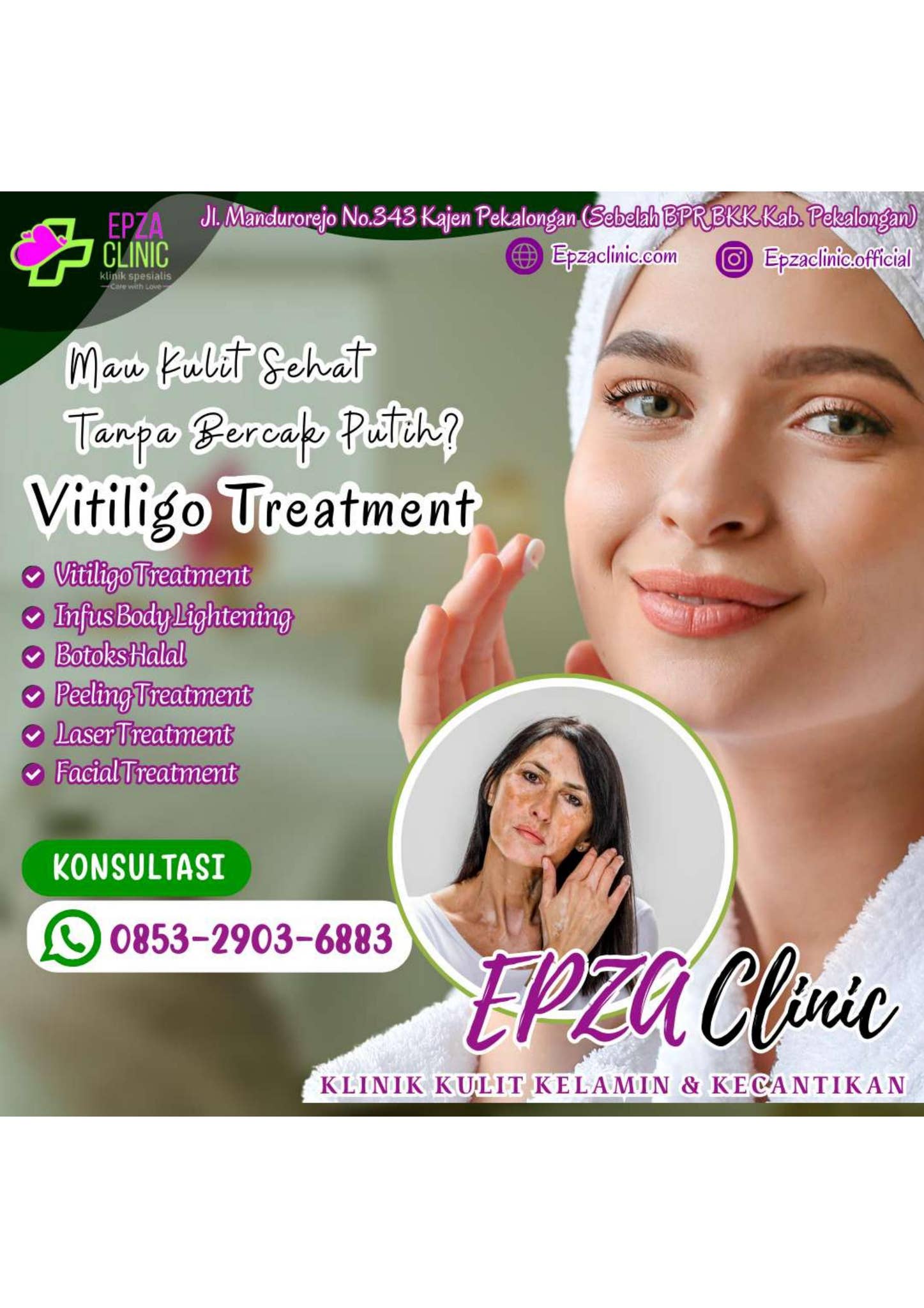 TREATMENT Bercak Putih Di Kulit Paha HUBUNGI LANGSUNG 0853-2903-6883 ...