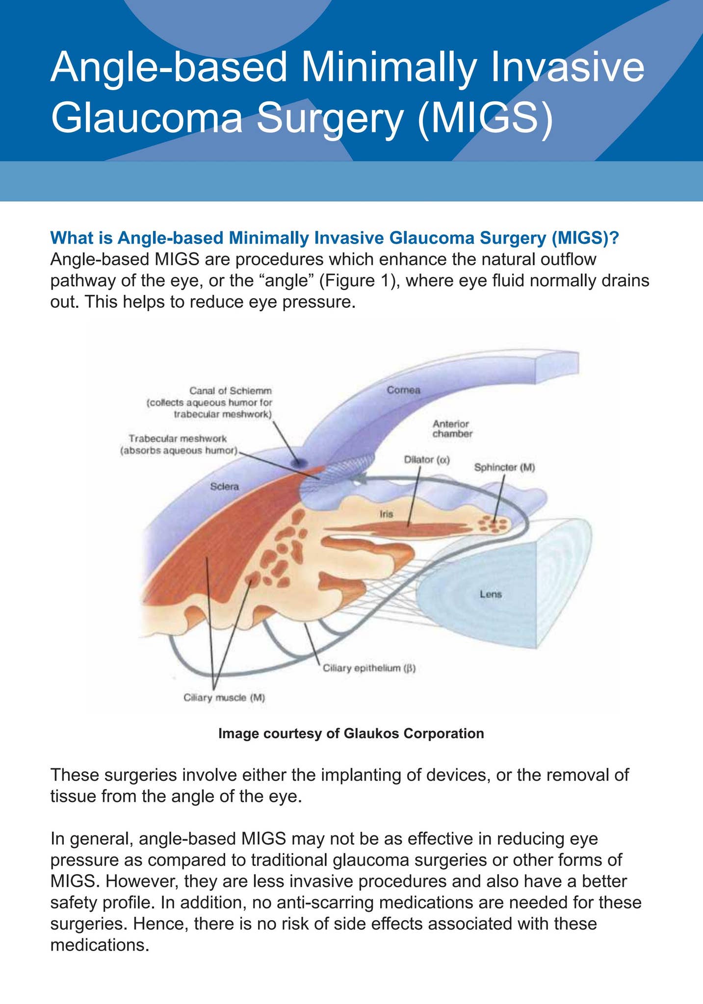 Angle-based Minimally Invasive Glaucoma Surgery (MIGS) by KTPH_YCH - Issuu