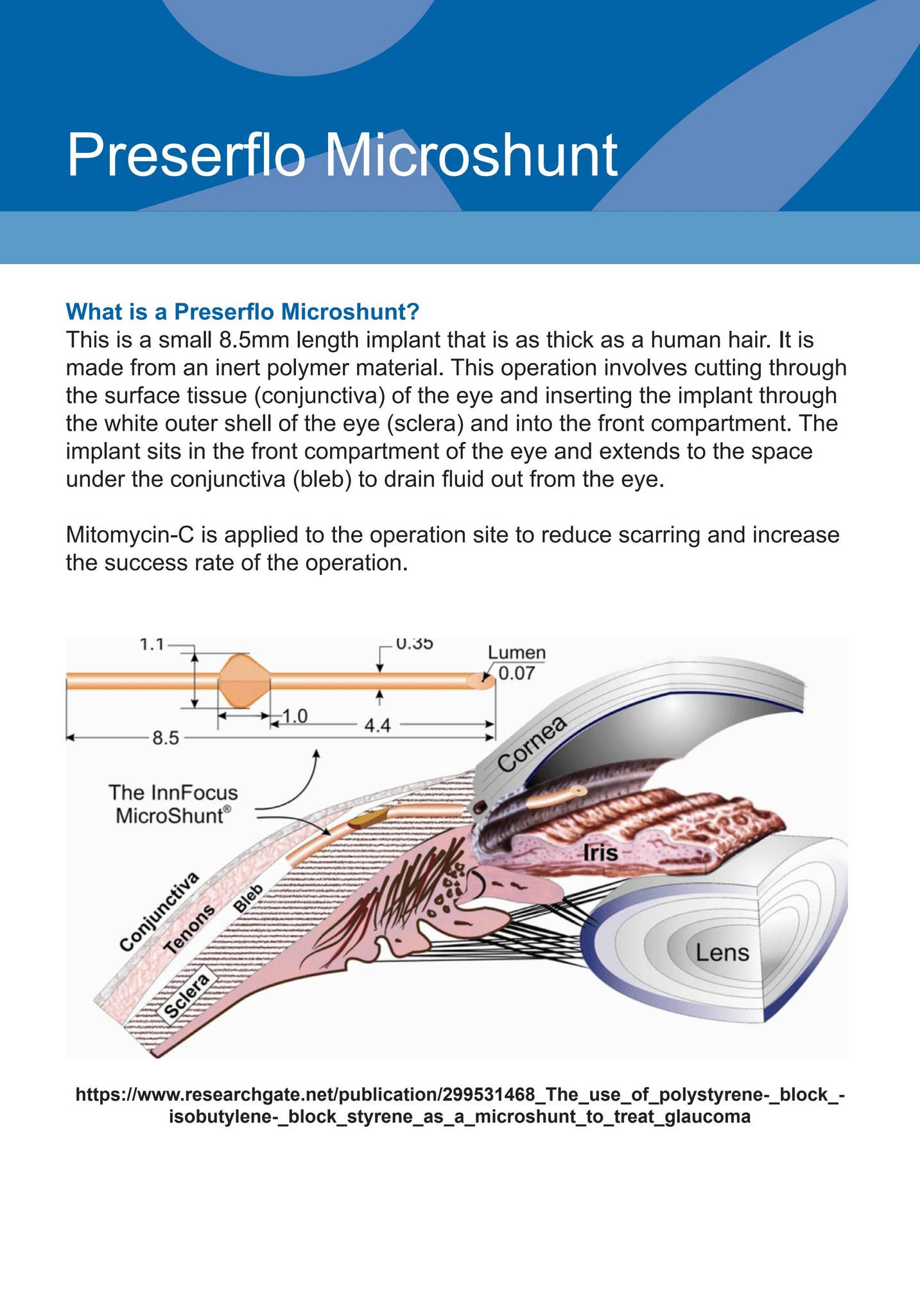 Preserflo Microshunt by KTPH_YCH - Issuu
